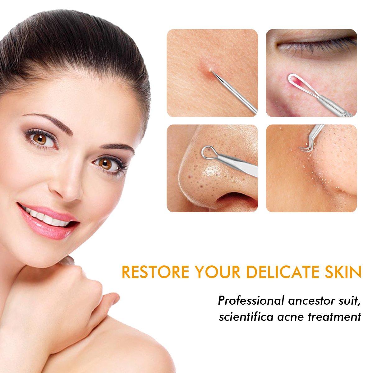 Blackhead Remover Kit - 7-Piece Pimple Extractor Tool Set for Facial ...