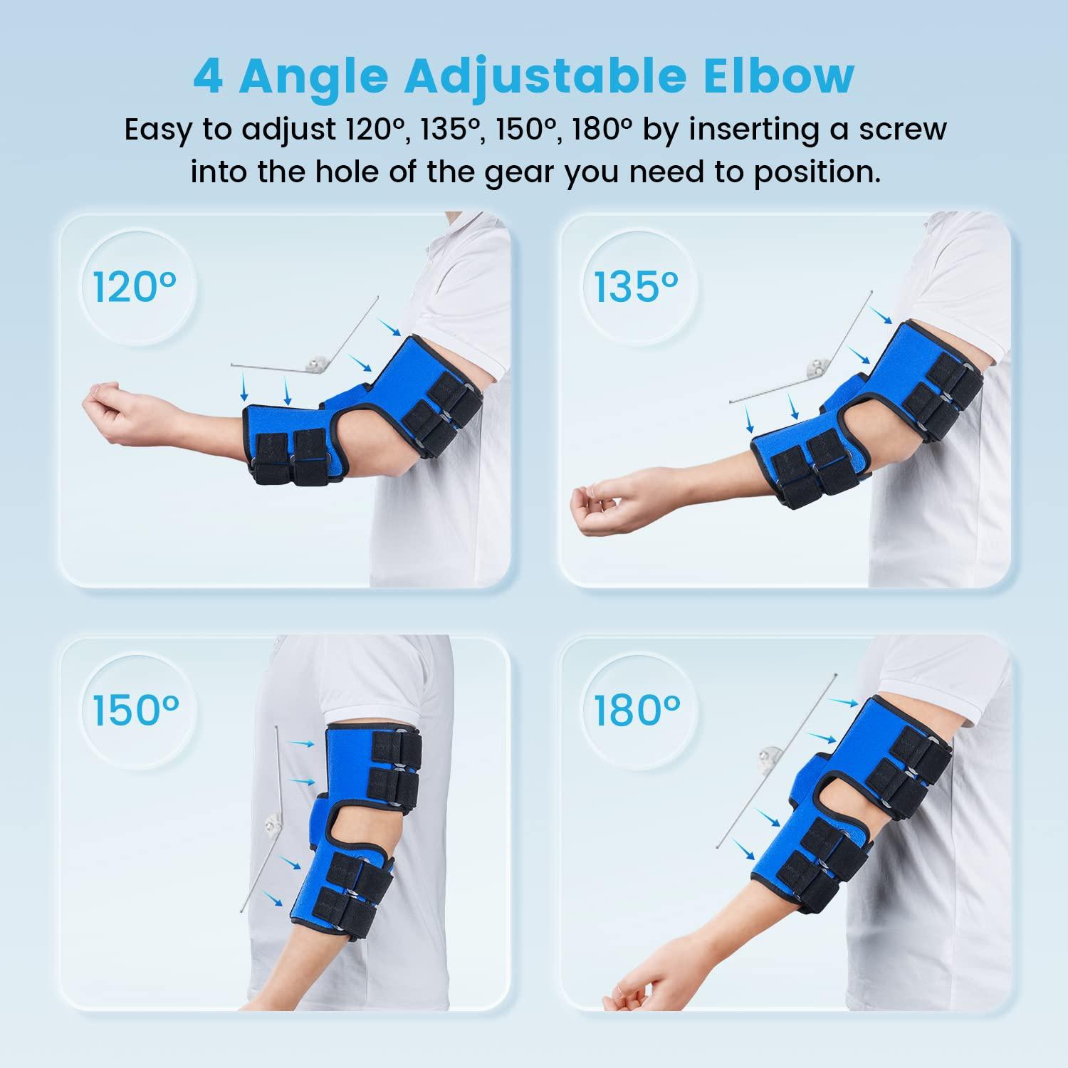Elbow Splint Brace for Cubital Tunnel Syndrome - 4 Adjustable Angles, Prevent Excessive Bending ...