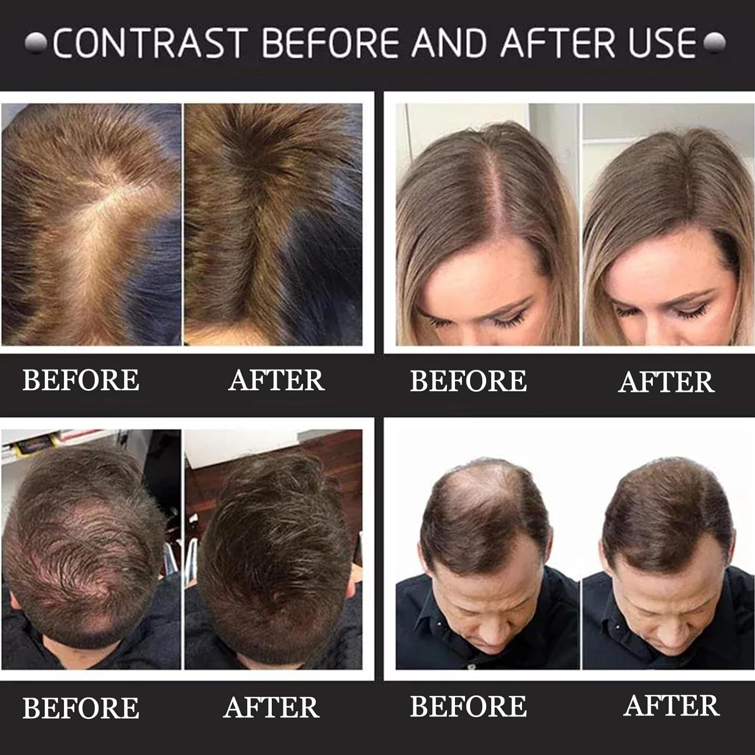 Hair Fibres Black Thick Fiber Hair Fibres For Instant Thicking Hair