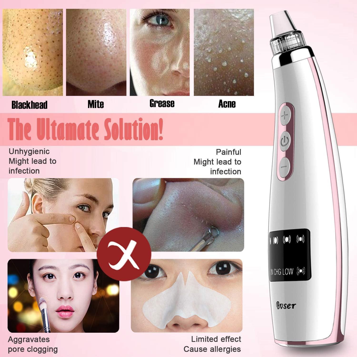 Blackhead Remover Vacuum Kit | Electric Pore Cleaner Tool with 6 Probes ...
