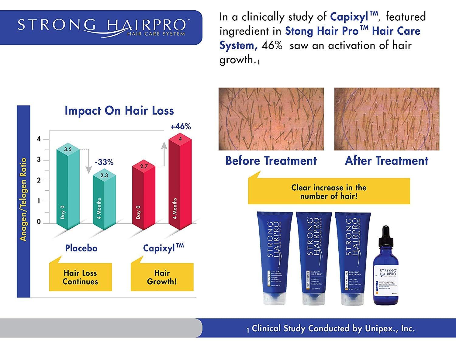 Strong HairPro Deep Scalp Hair Therapy Serum - 2 oz - Follicle ...