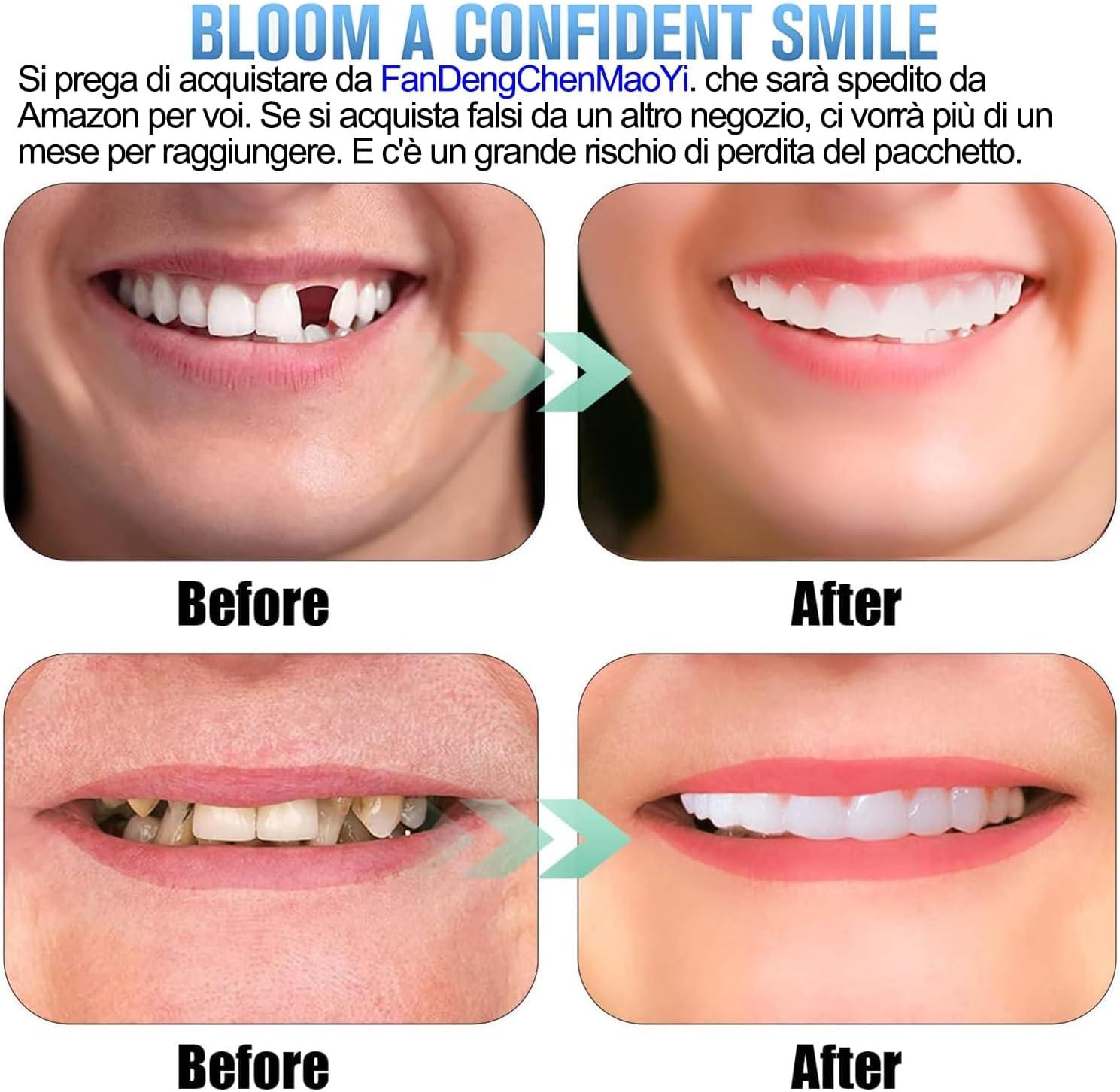 2 Sets of Comfort Fit Fake Braces & Instant Perfect Smile Veneers ...