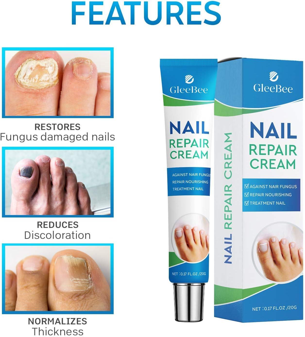 Fungal Nail Treatment Cream - Strong Anti-Fungal Toenail Repair and ...