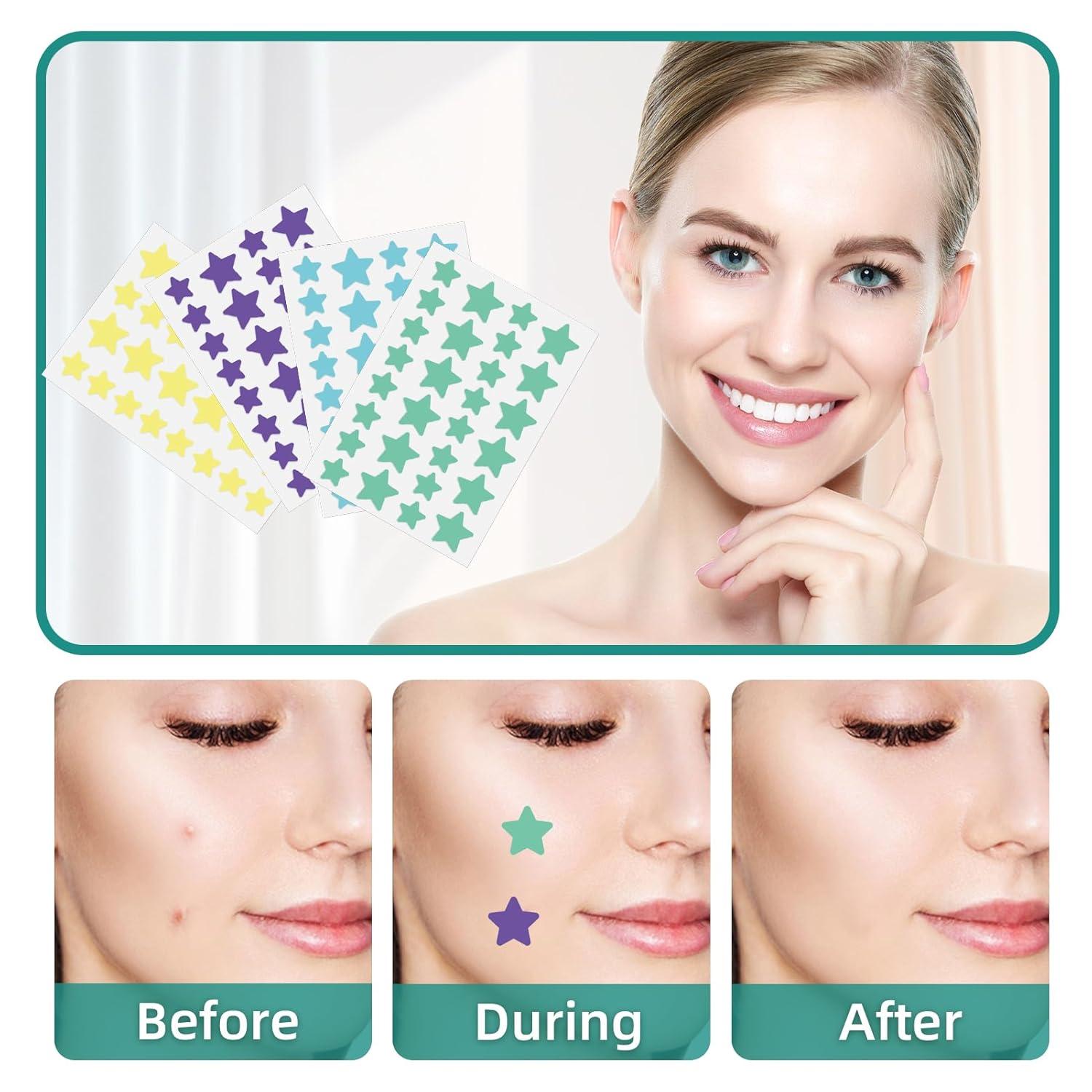 112 Counts Star-Shaped Pimple Patches - Hydrocolloid Acne Stickers for ...