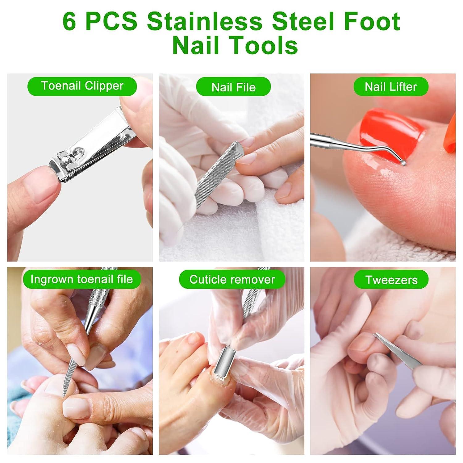 Ingrown Toenail Removal Kit - 11 Pcs Pain Treatment Tools for Seniors ...