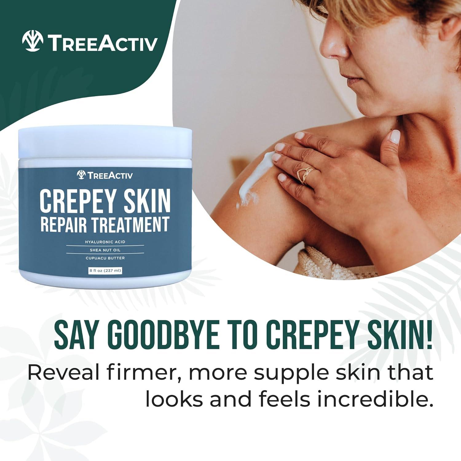TreeActiv Crepey Skin Repair Treatment - Firming Cream with Hyaluronic ...