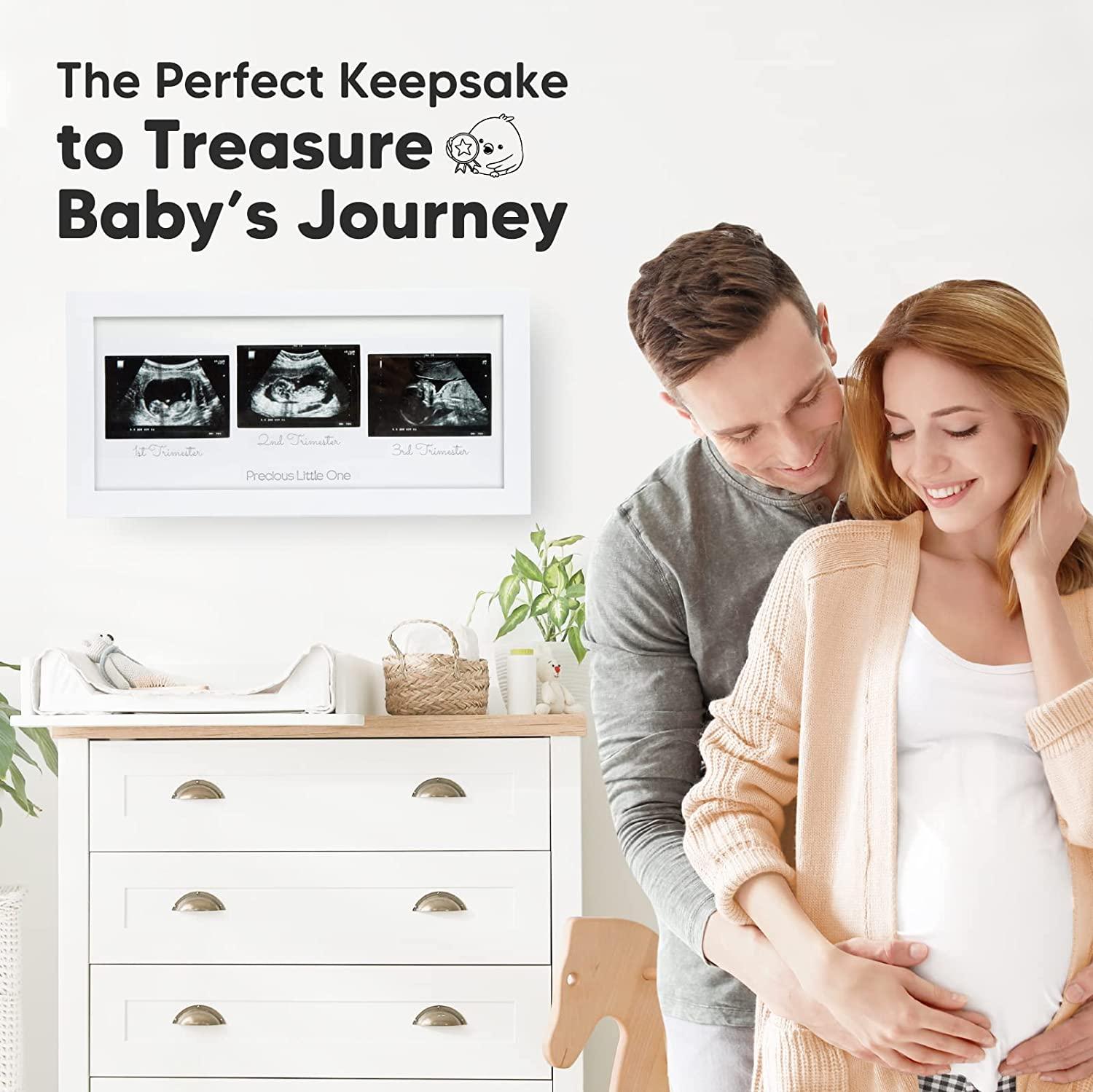 Sonogram Picture Frame Trio - Ultrasound Frames for Mom to Be - Baby ...