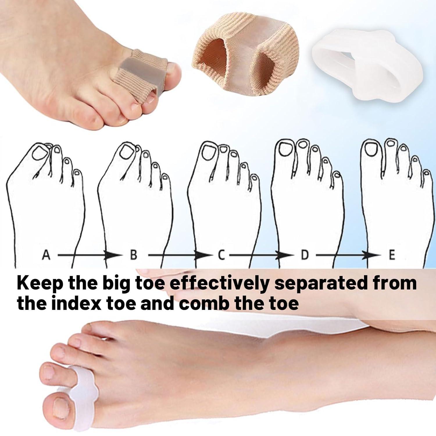 Mercury 2 Ballen Toe Spreader | Gel Bunion Corrector & Soft Spacers for ...