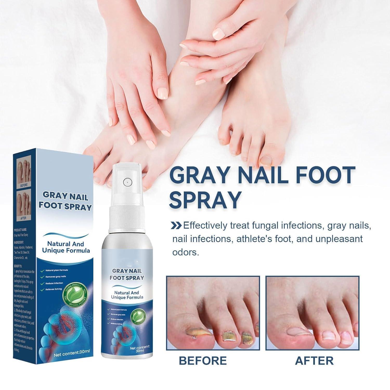 3 Pcs Furzero Athletes Foot & Nail Treatment Spray - Medical Grade Anti ...