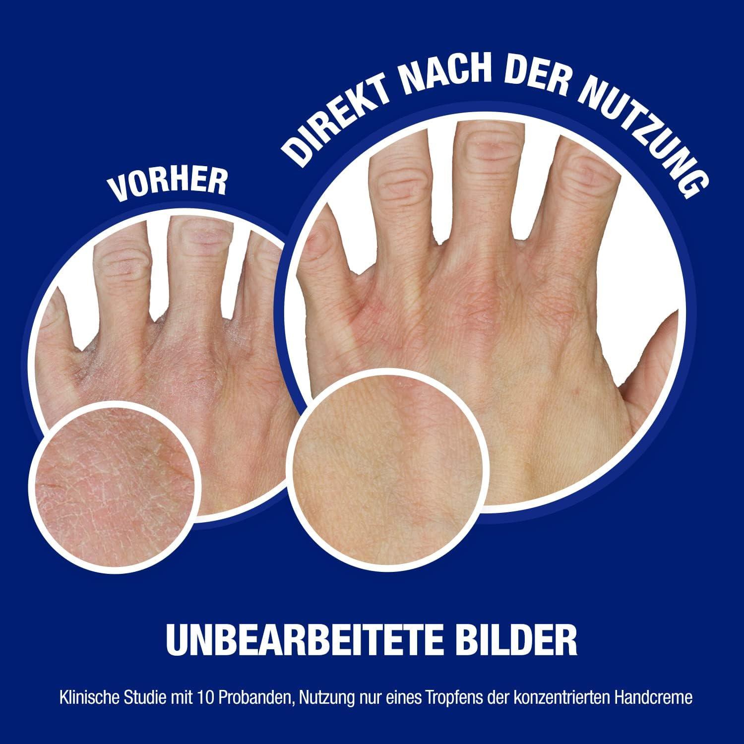Buy Neutrogena Unscented Hand Cream 50 ml - Moisturizing Relief for Dry ...
