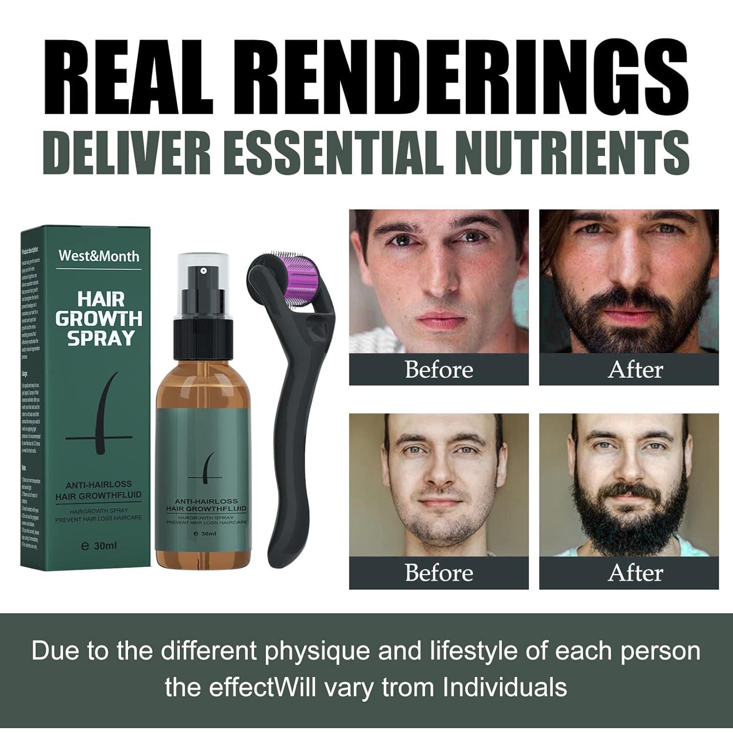 Buy Bart Spray Set - Moisturizing Beard Care | Promotes Thick Growth ...