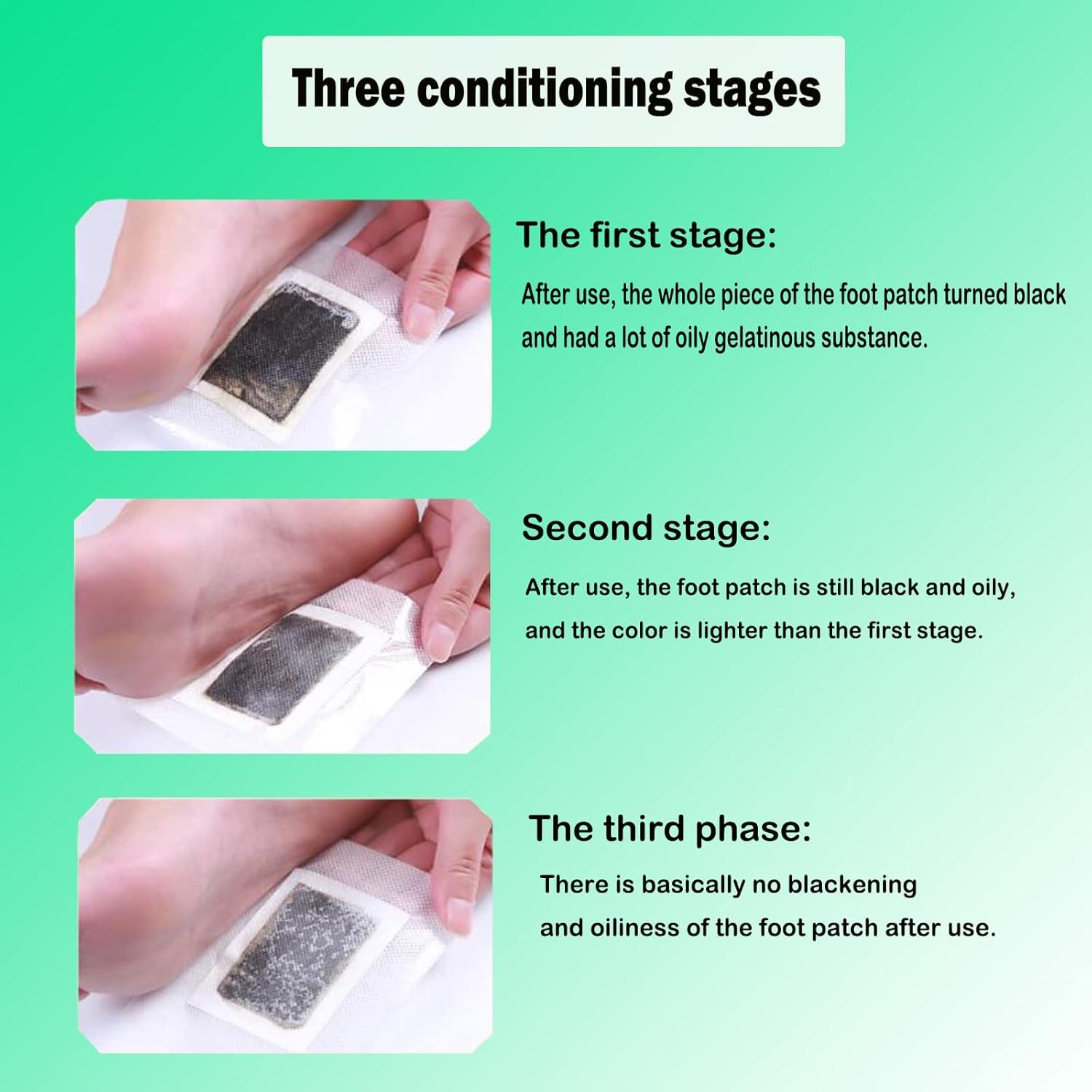 Detoxification Plaster for Feet - 100 Natural Deep Cleansing Foot Pads ...