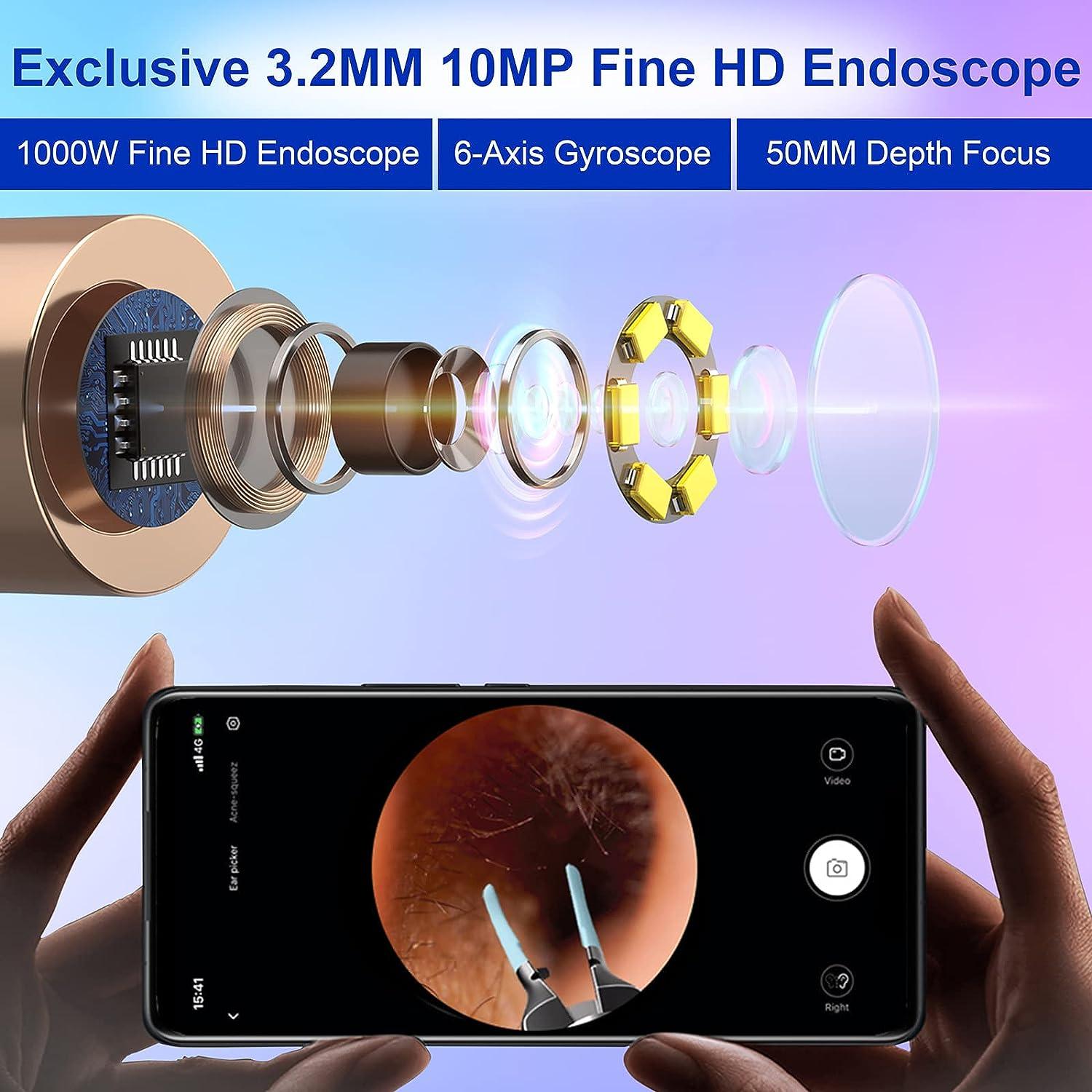 Bebird Note5 Pro Ear Wax Removal Tool Camera | 10MP HD Otoscope with Light | Ear Cleaner with ...