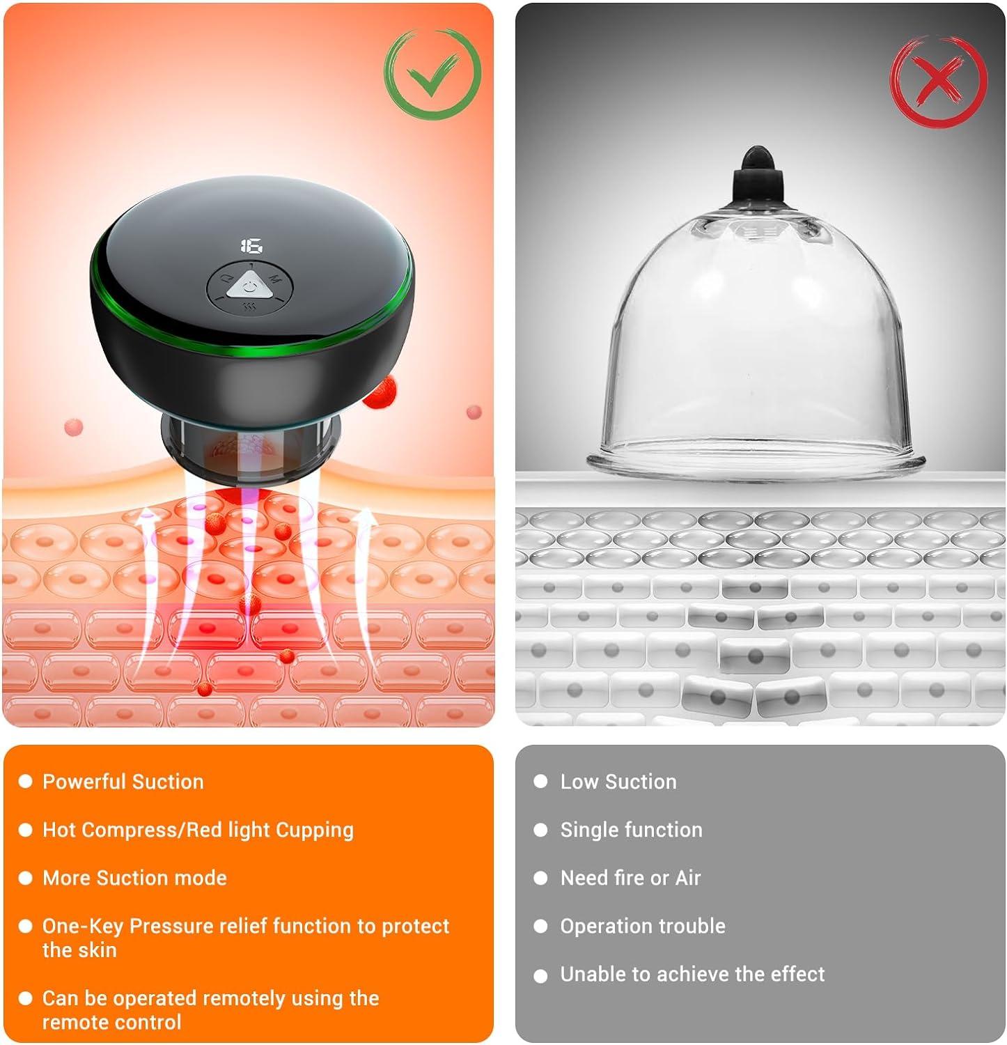 Intelligent Cupping Therapy | Kamanan Electric Cupping with Infrared 16 ...