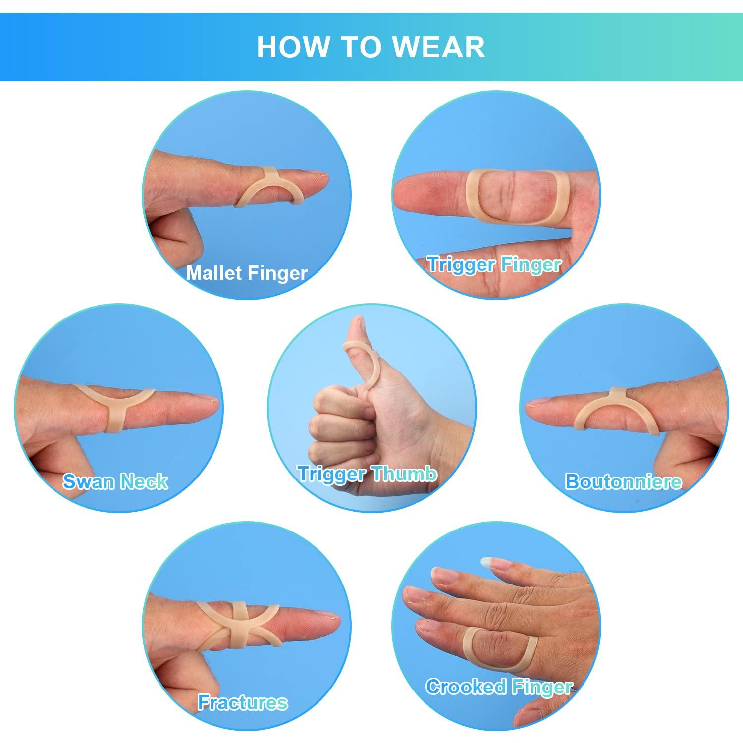 AIEX 5pcs Oval Finger Splint Set for Trigger Finger Support - Thumb ...