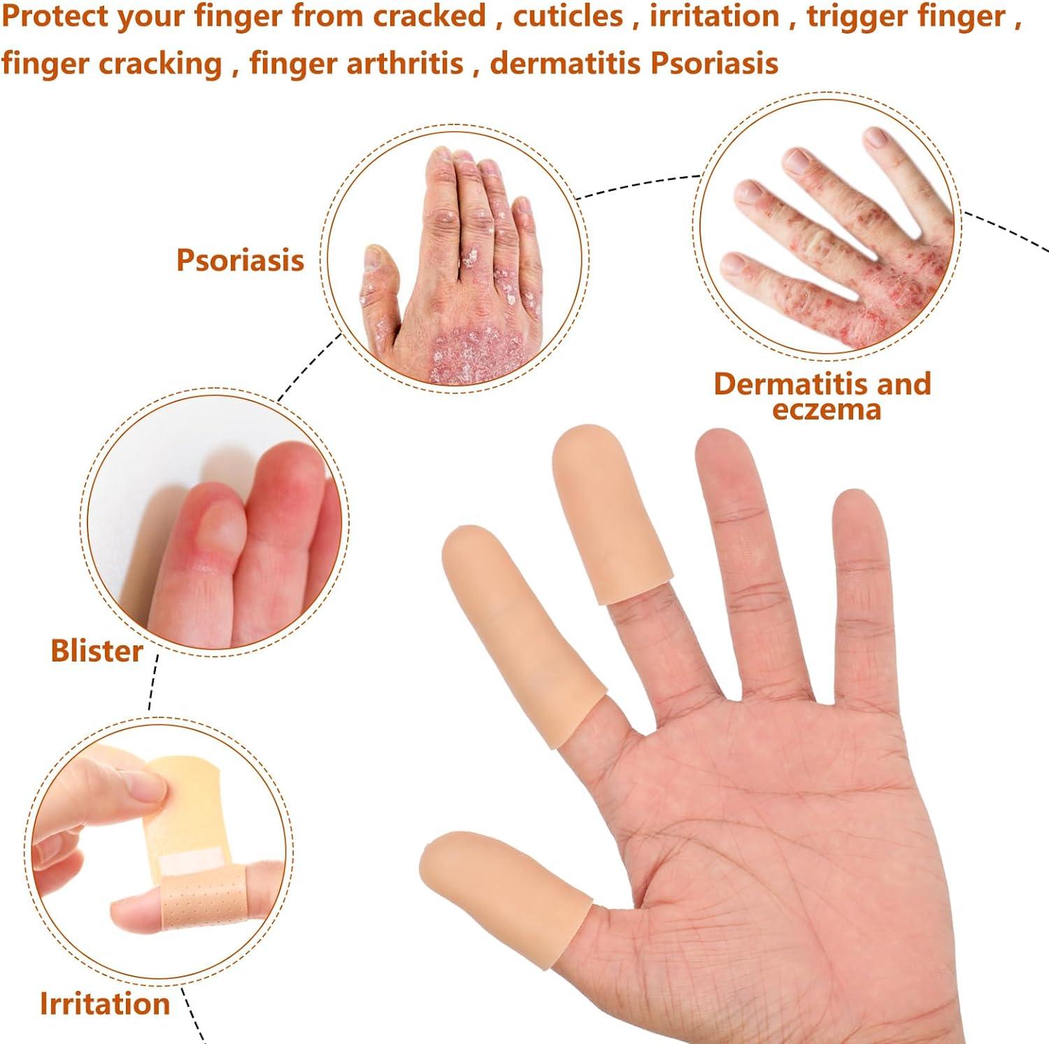 Gel Finger Cots - 20 Pack Silicone Finger Protectors for Dry Skin ...