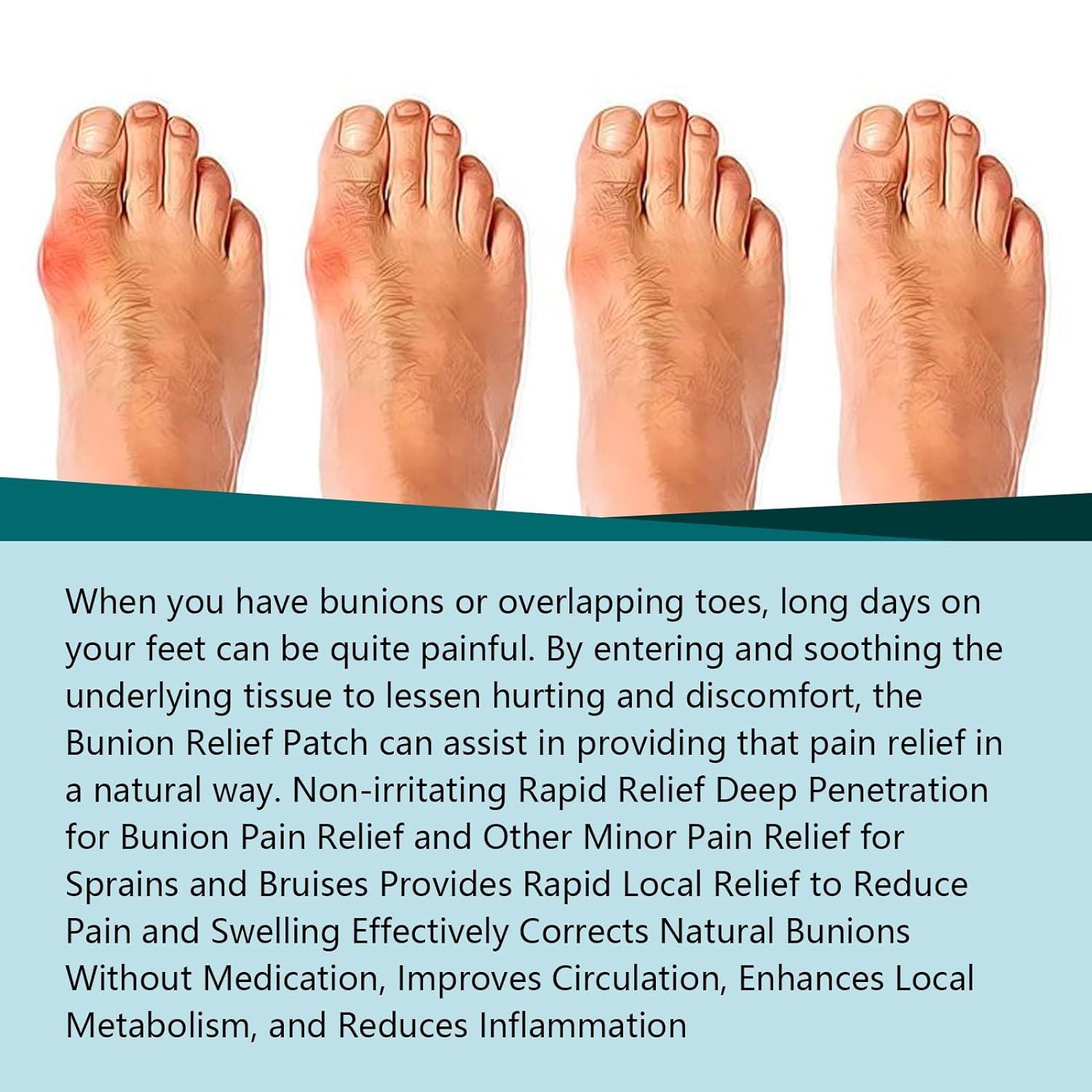 Bunion Relief Fit Patch - Pain Relieving Bunion Corrector Pads (1 Box ...