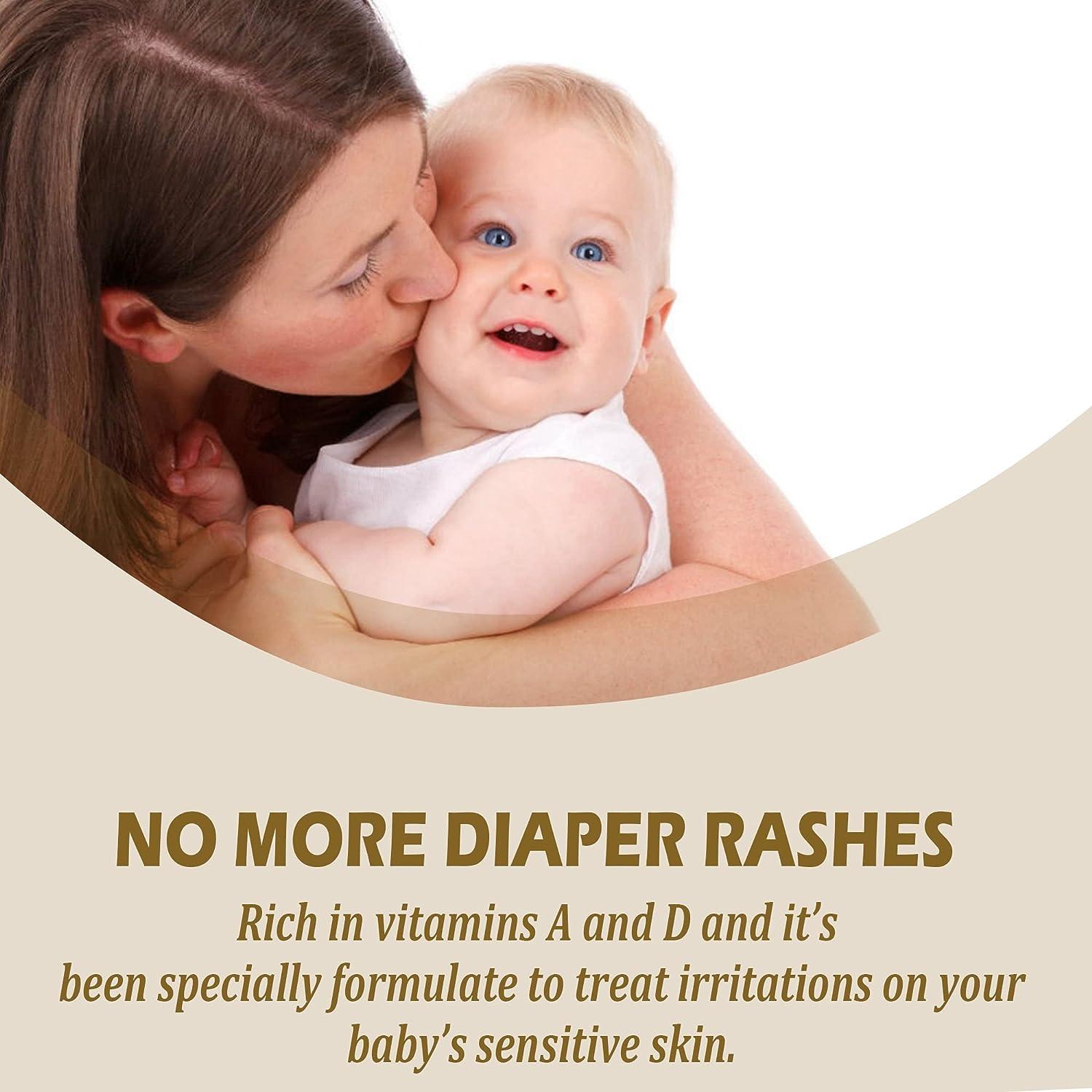 Sion Biotext Baby Diaper Rash A&D Ointment (4oz) - Healing Cream for ...