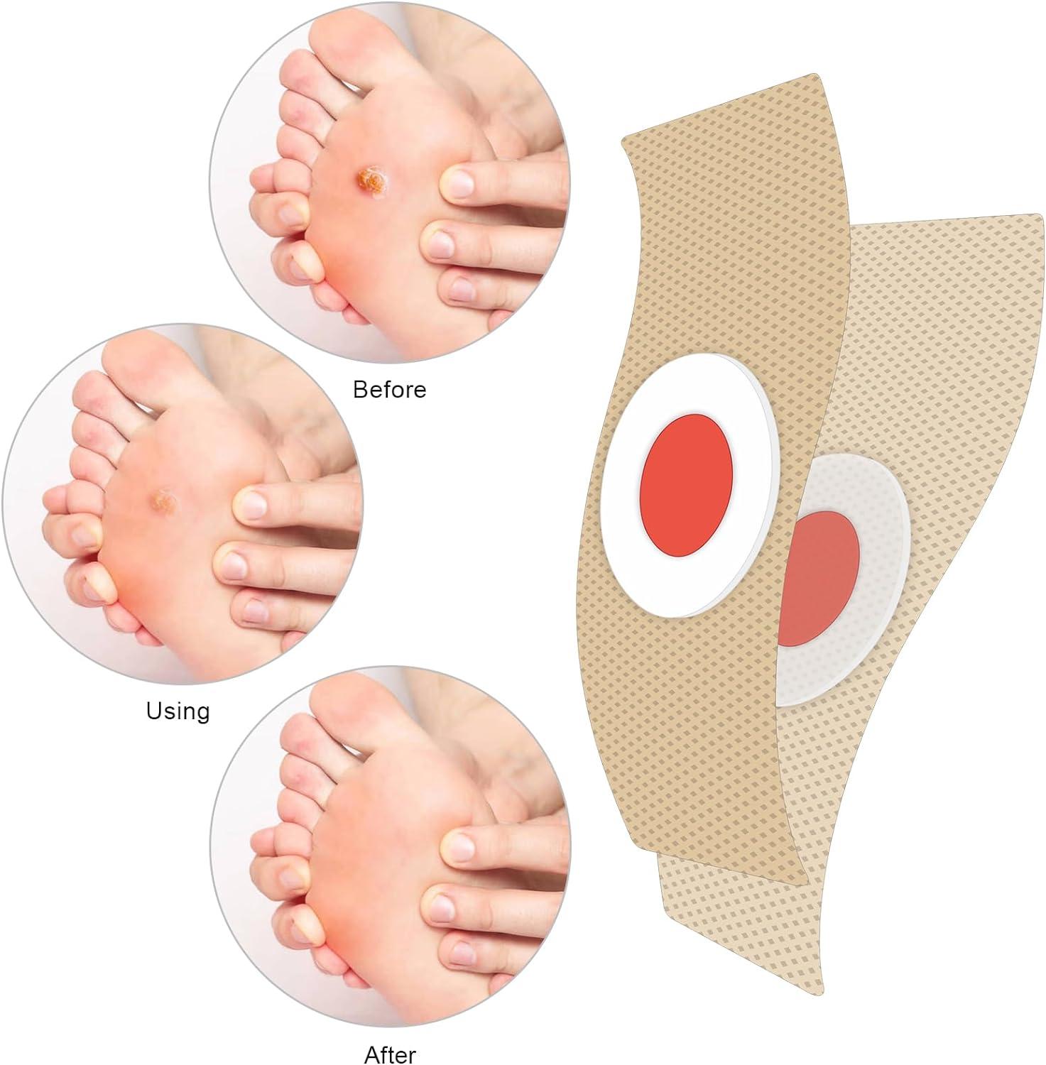 Corn Remover Pads - 42 Pcs Wart & Foot Corn Removal Patches for Pain ...