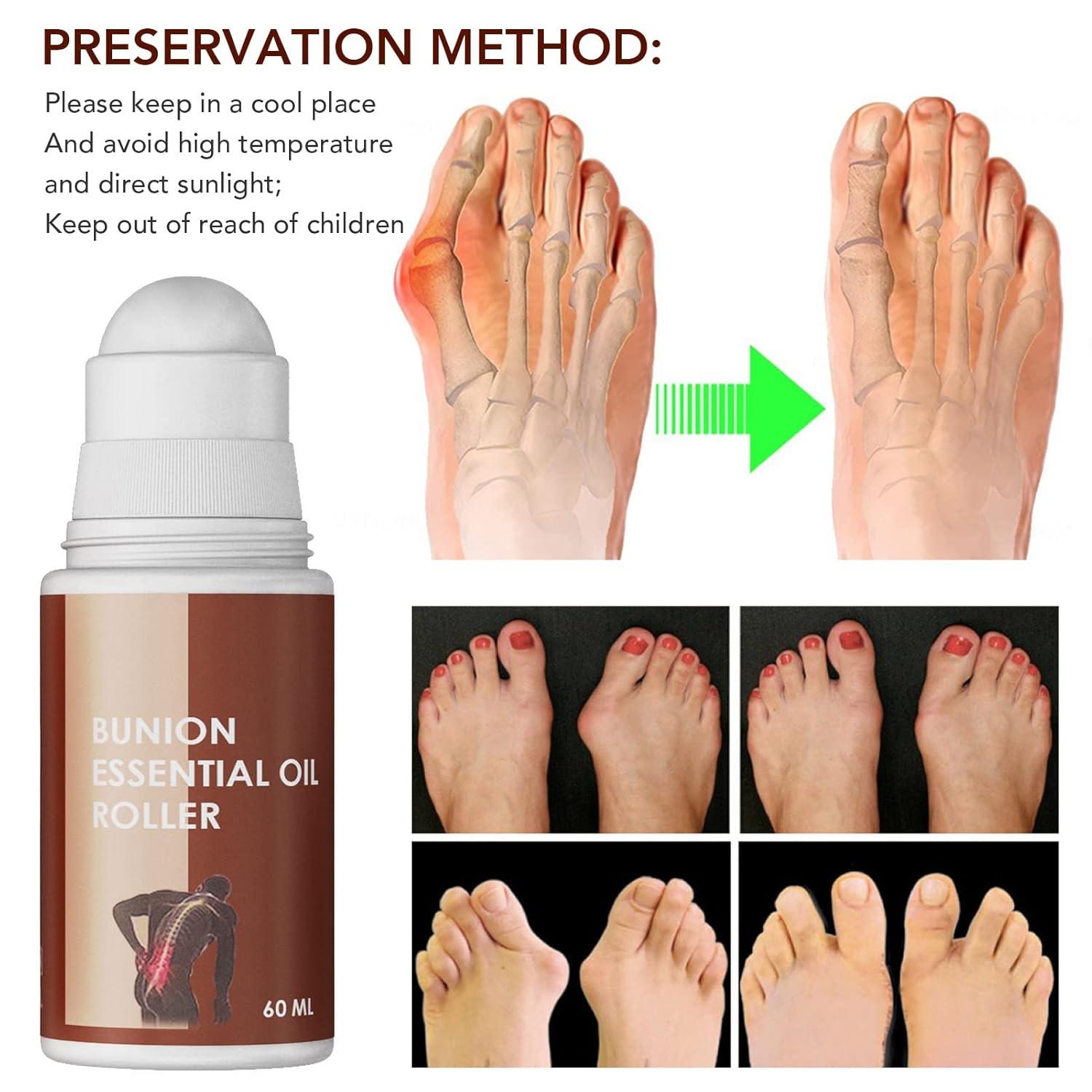 Essential Toenail Oil 60ml - Rapid Relief for Swelling & Discomfort ...