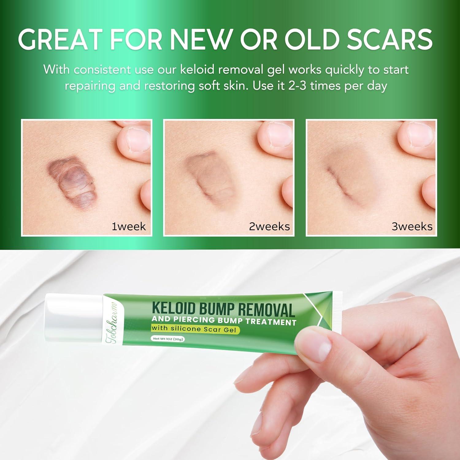 Advanced Keloid Bump Removal Gel - Silicone Scar Treatment for Piercing ...