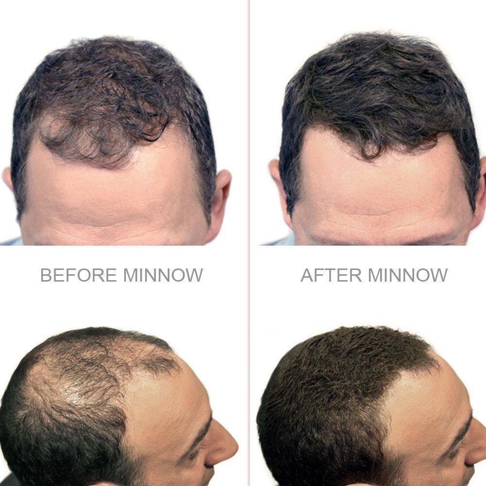 Natural Hair Loss Concealer - Hair Building Fibers for Men and Women 0 ...