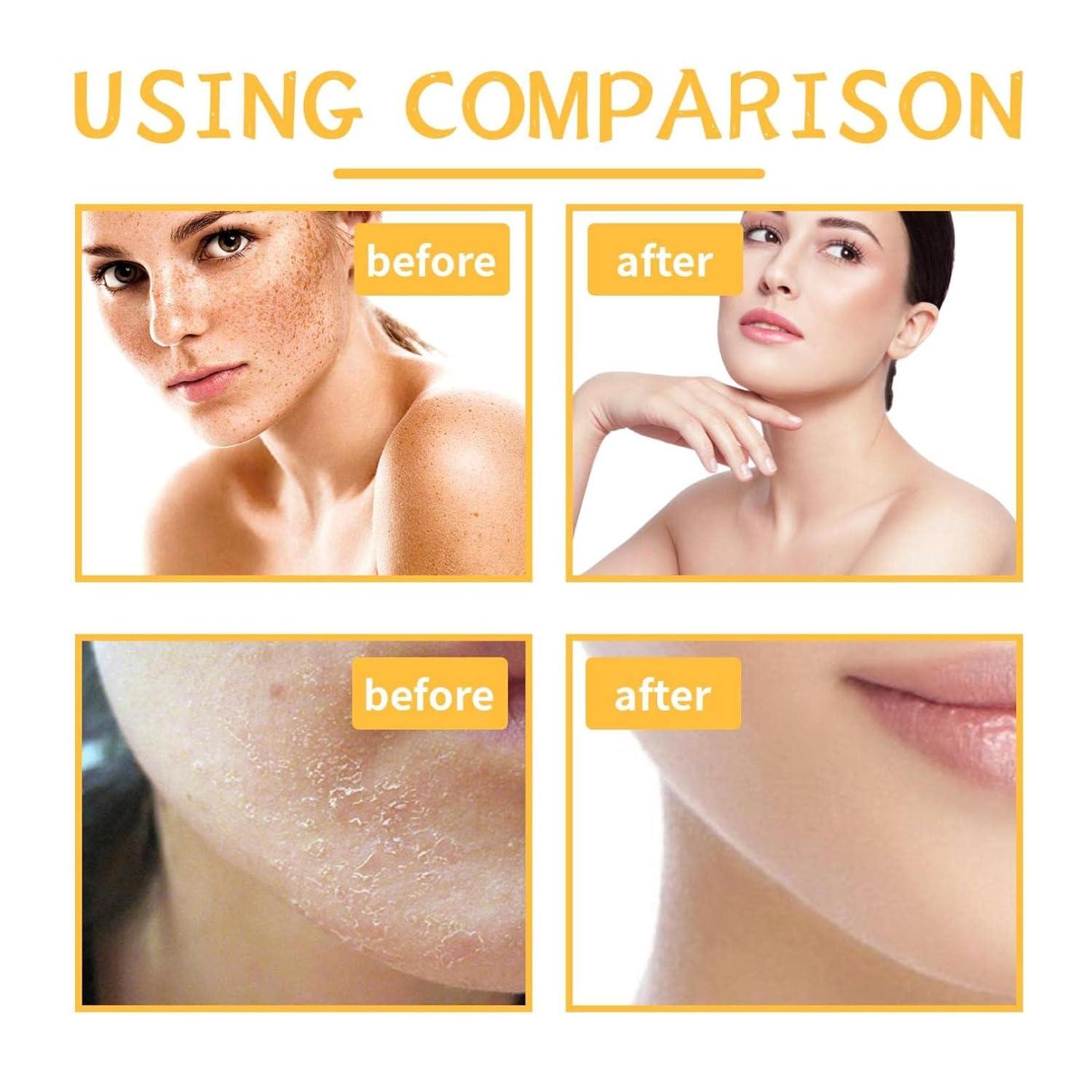 Turmeric Brightening Body Scrub for Dark Inner Thighs, Bikini Area ...