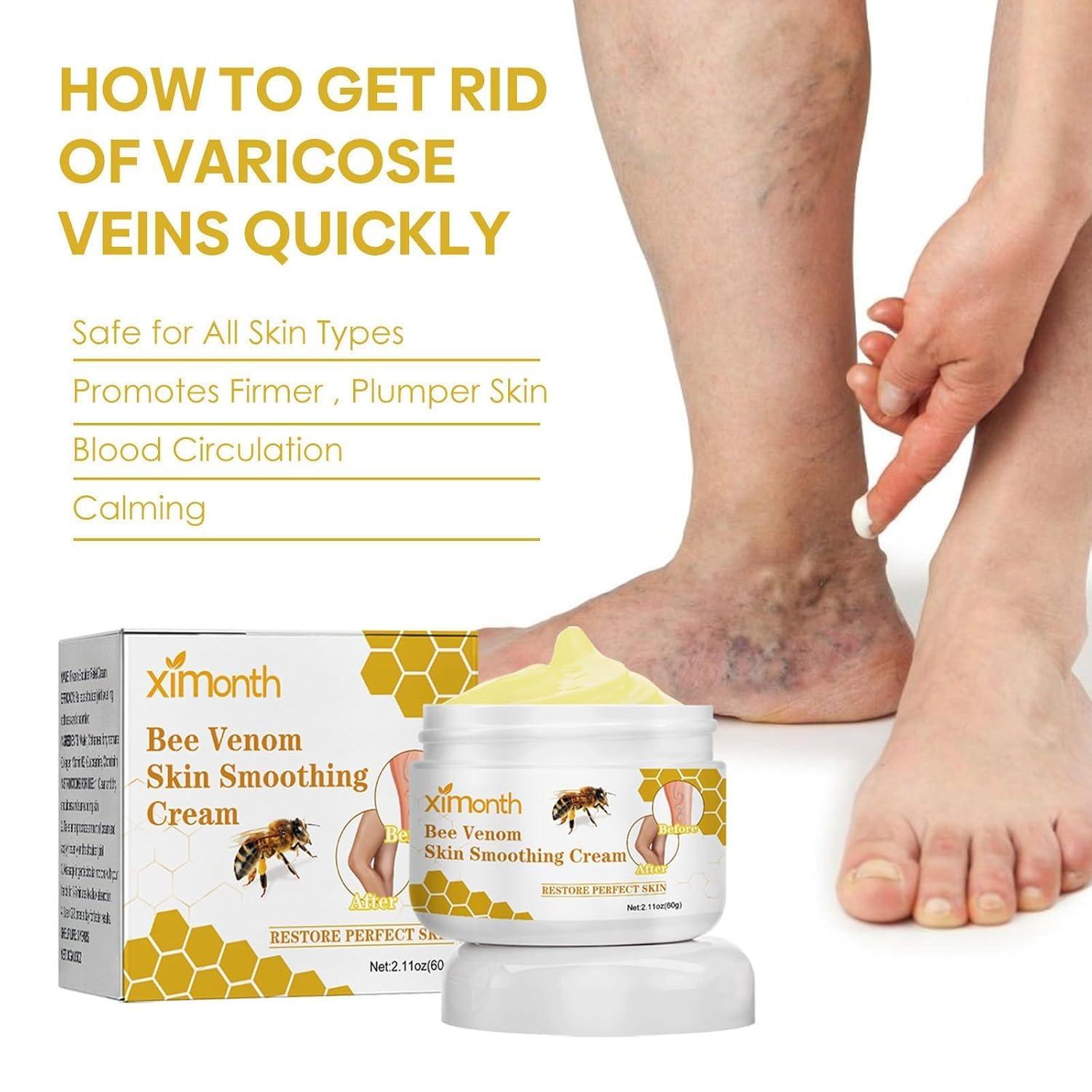 Furzero Bienengift Varicose Veins Cream - Best Spider Vein Relief ...