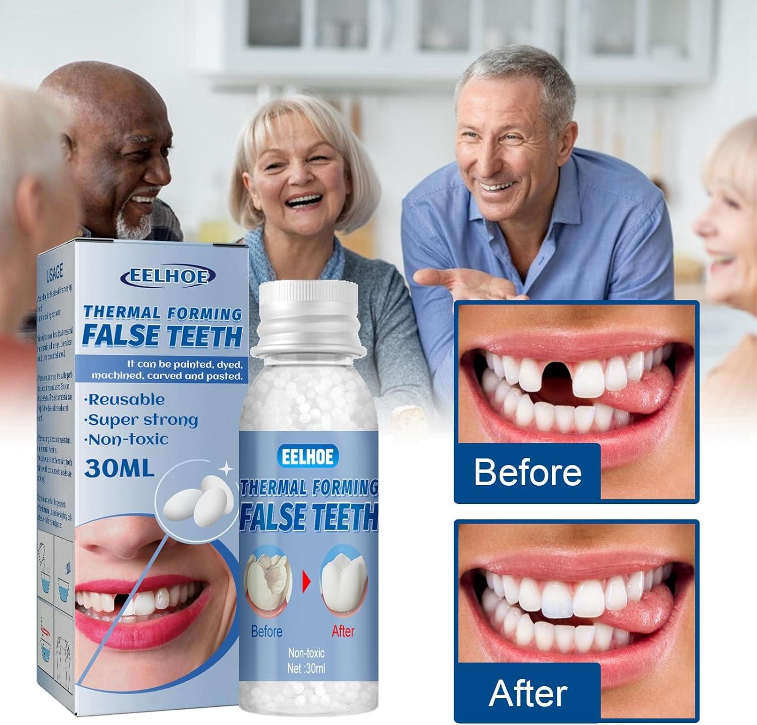 Temporary Tooth Filling Tooth Filling Repair Kit Tooth Repair Beads ...