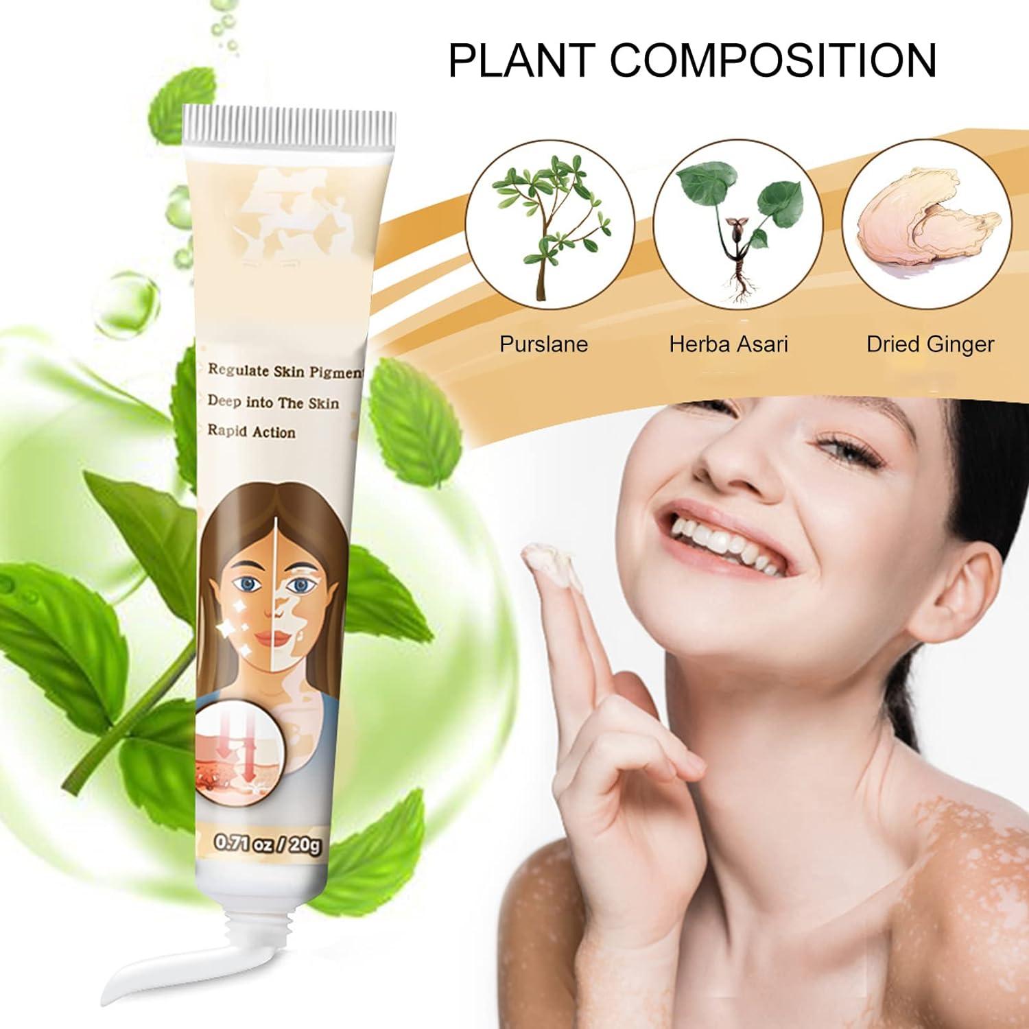 Professional Vitiligo Cream with Herbal Extract for Skin Pigmentation ...