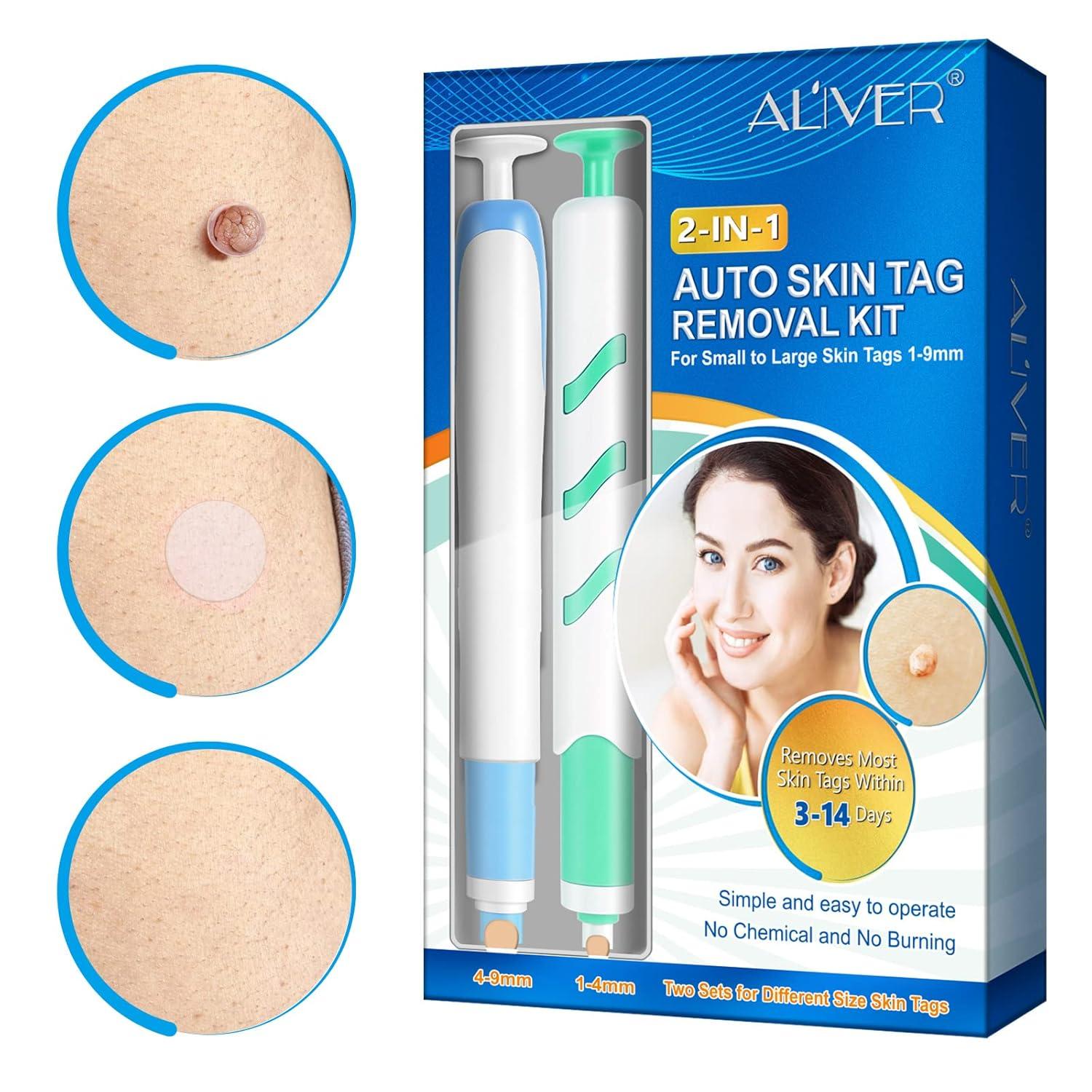 Skin Day Remover Kit | Quick & Painless Wart Removal | Safe for Micro ...