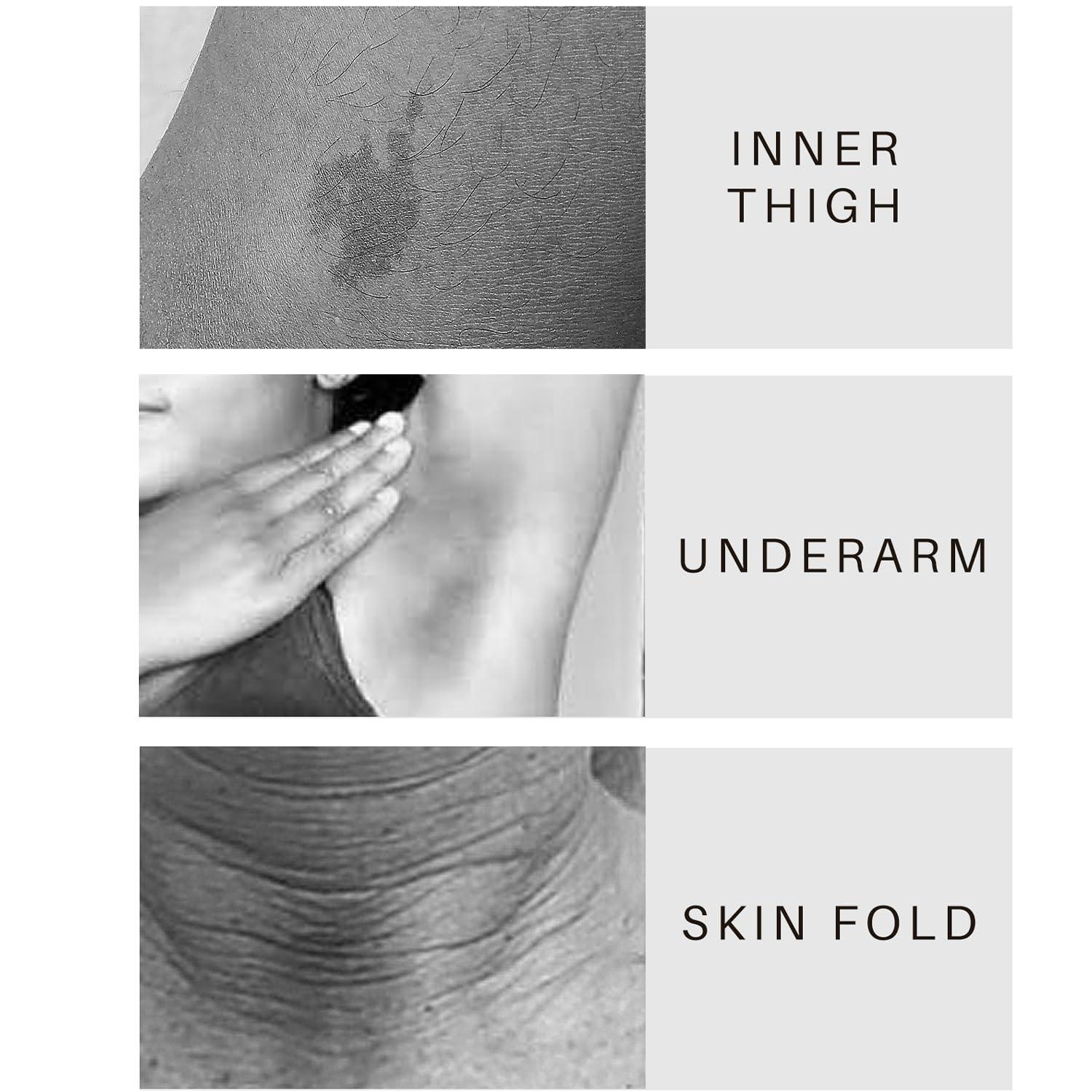 Armpit Cream & Body Pigment Removal Gel | Moisturizing Care for ...