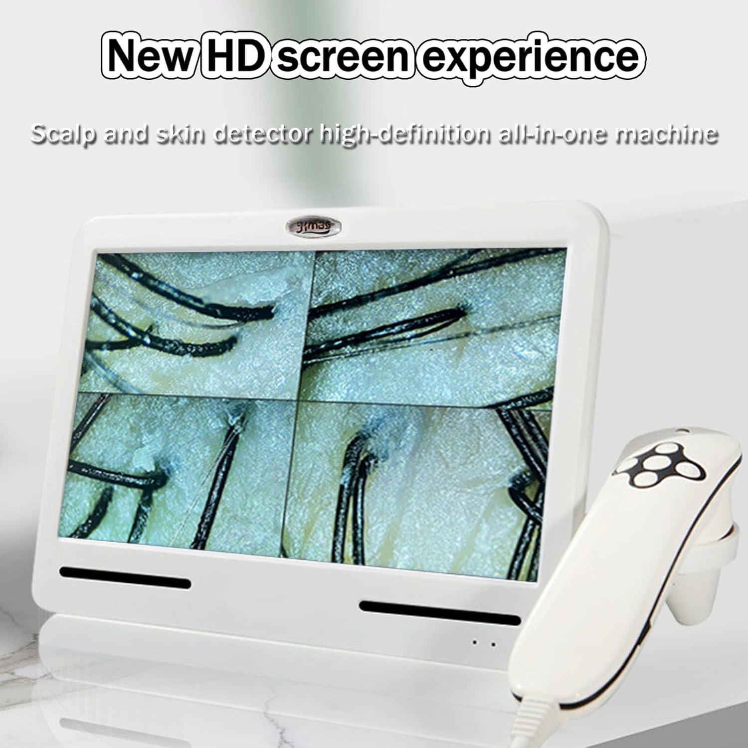 10.1inch Skin Scalp Detector Skin Diagnosis Hair Analyzer Hair Microscope Hair Analyzer Analysis ...