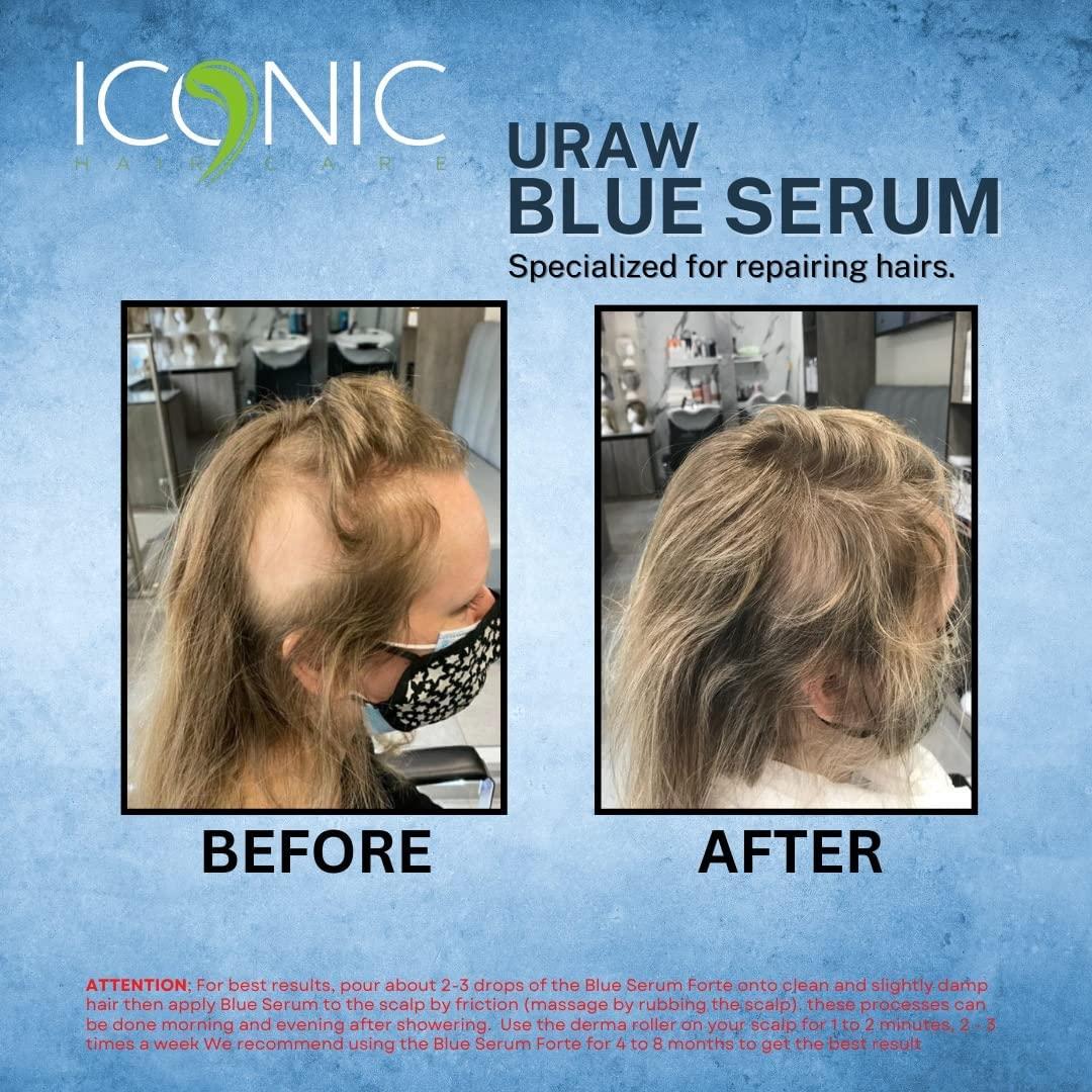 URAW Blue Serum 100ml - Effective Hair Growth & Anti-Hair Loss Serum ...