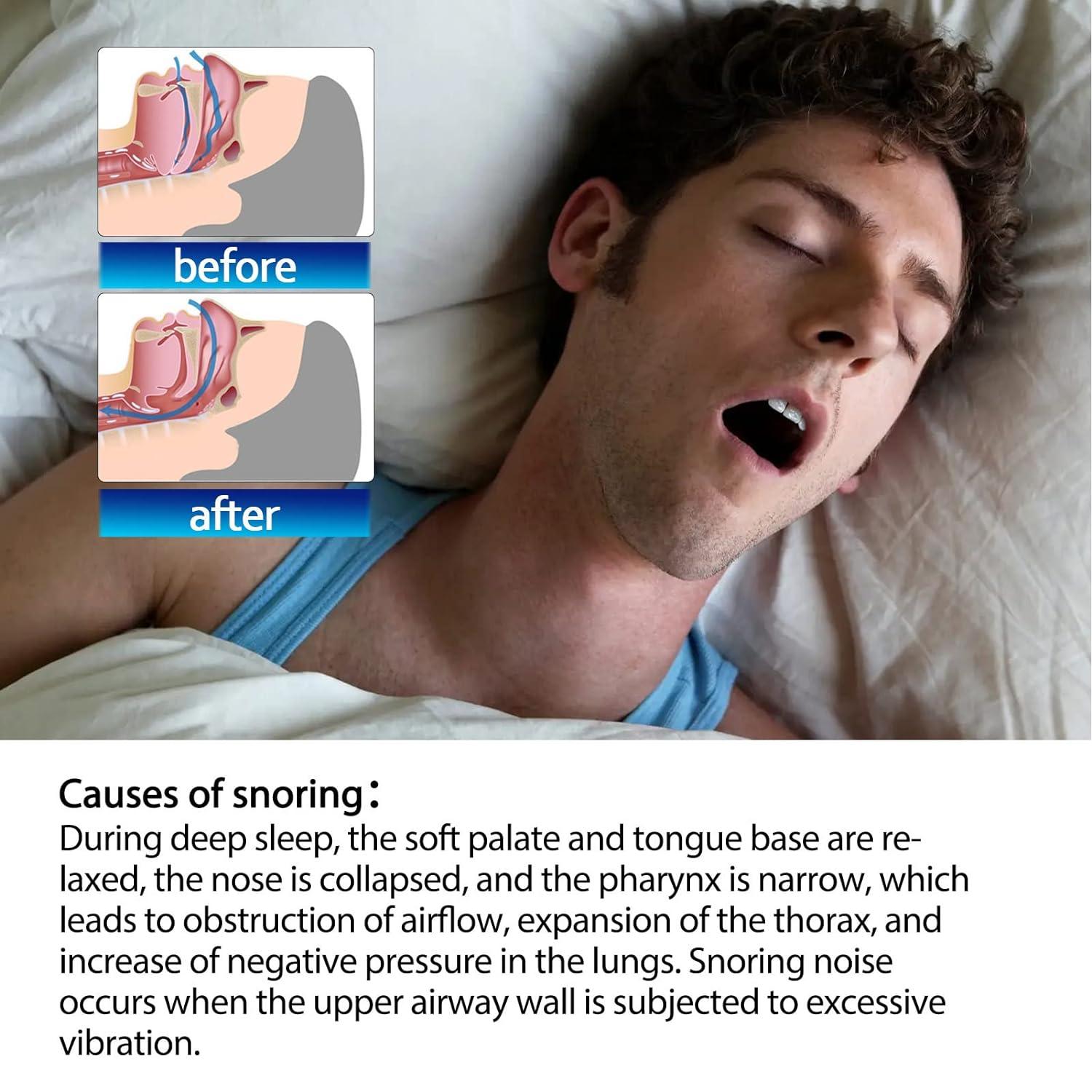 Snoring Nasal Strips for Easy Breathing and Stress Relief | Nighttime ...