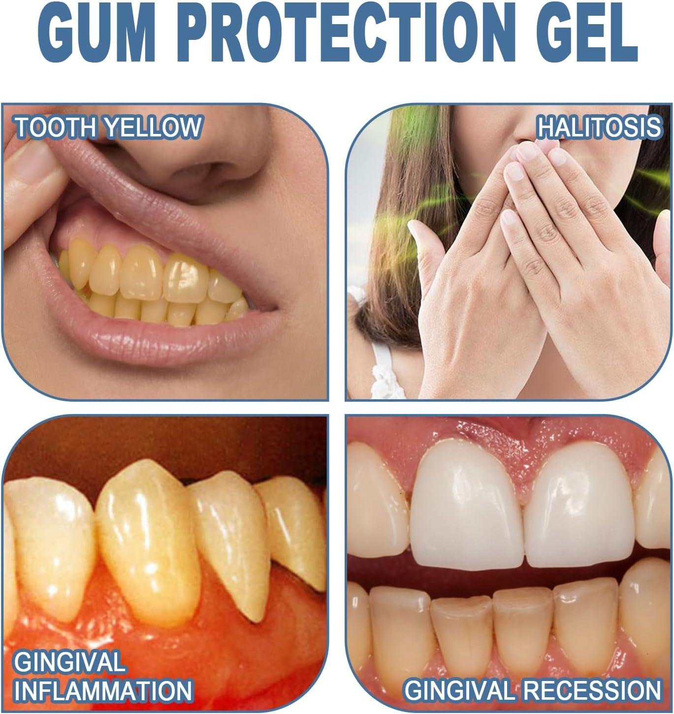 Advanced Gum Therapy Gel - Repair Swelling & Strengthen Gums (4 Pieces ...
