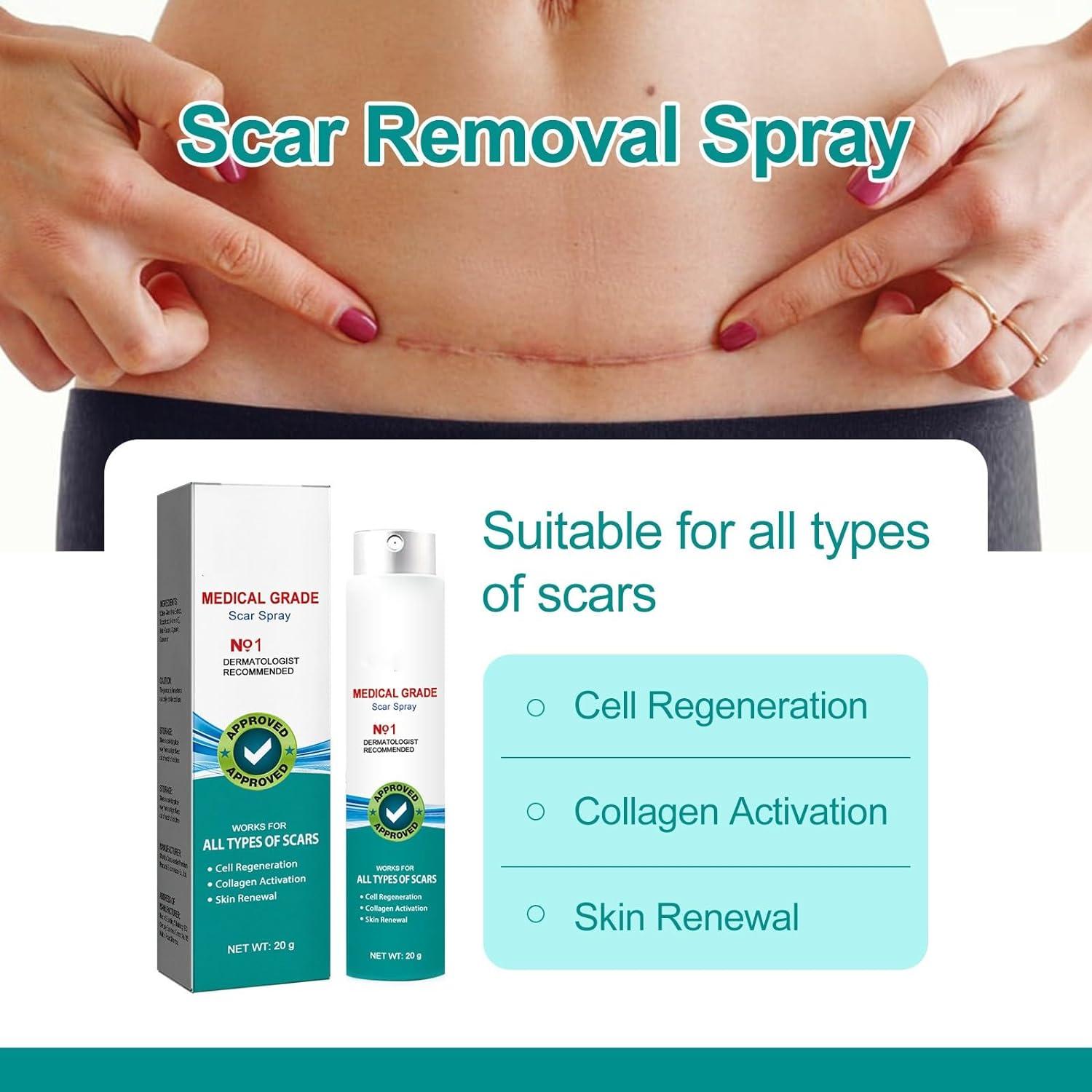 GINDAMU South Moon Medical Grade Scar Removal Spray - 1pcs | For All ...