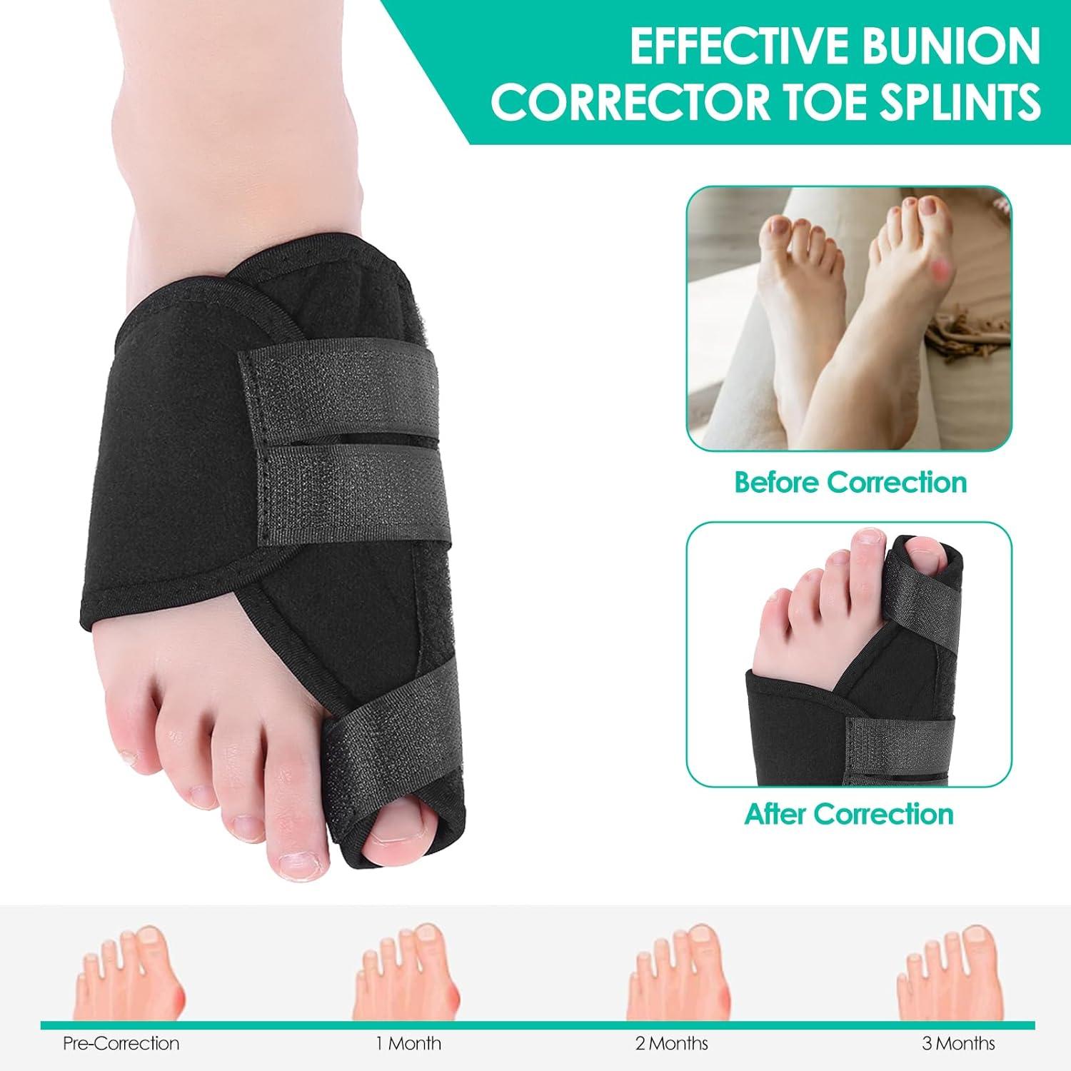 Kireina Bunion Relief Corrector - Nighttime Toe Separator for Hallux ...