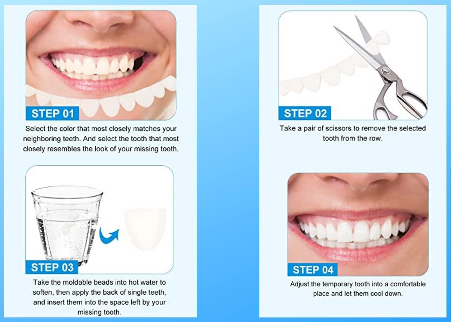 Temporary Tooth Replacement Kit Bundle Set - 30 Fake Teeth in 3 Shades ...