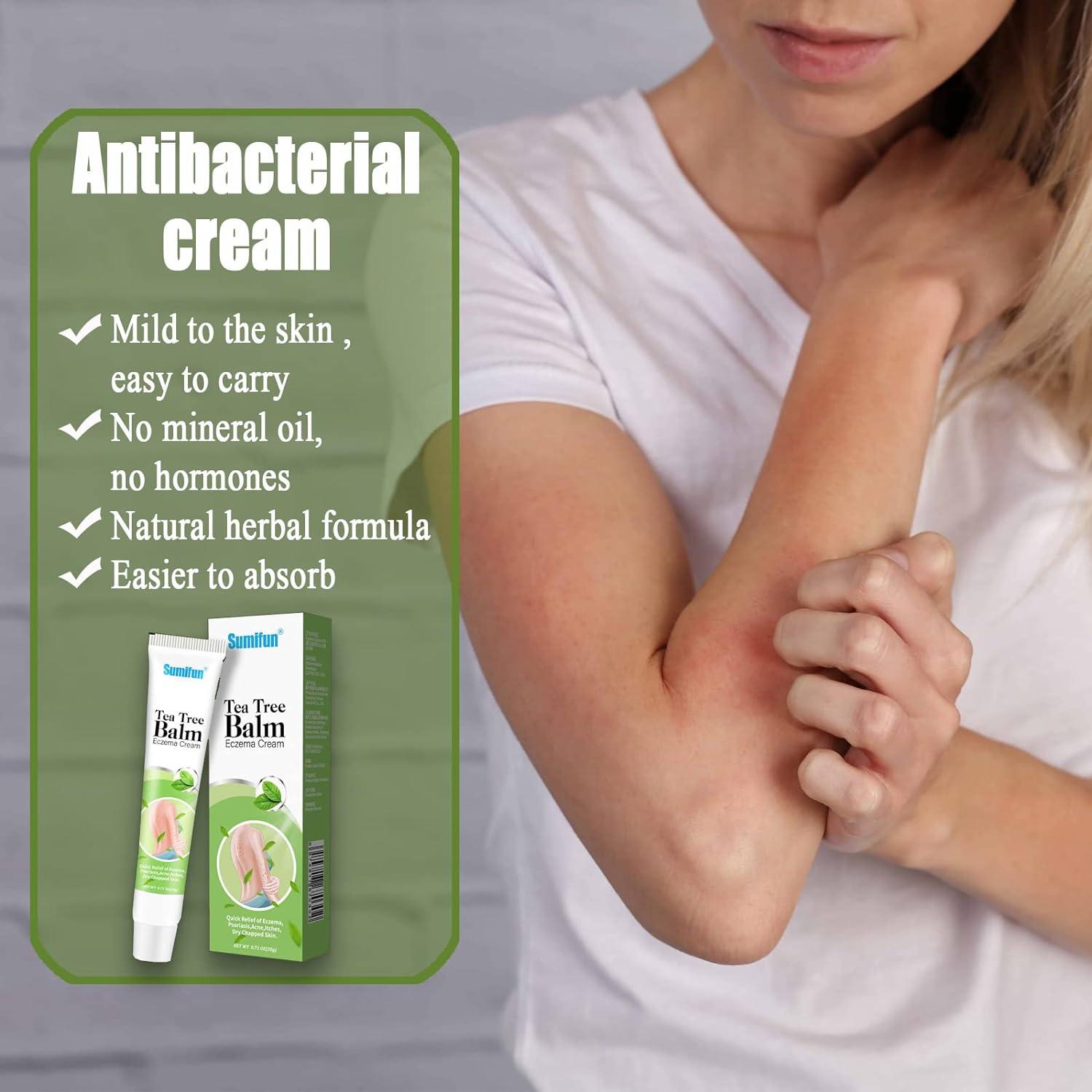 Tea Tree Oil Eczema Psoriasis Cream - Natural Anti-Itch Lotion for Dry ...