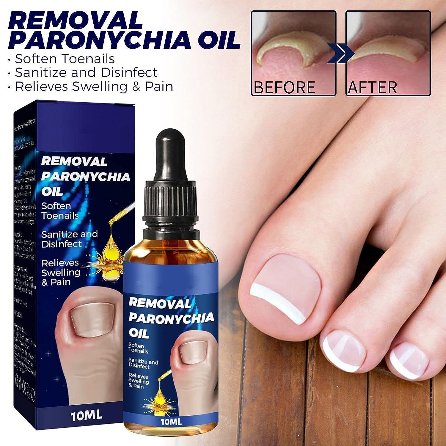 German Toenailcare Removal Paronychia Oil - Repair Damaged Discolored ...