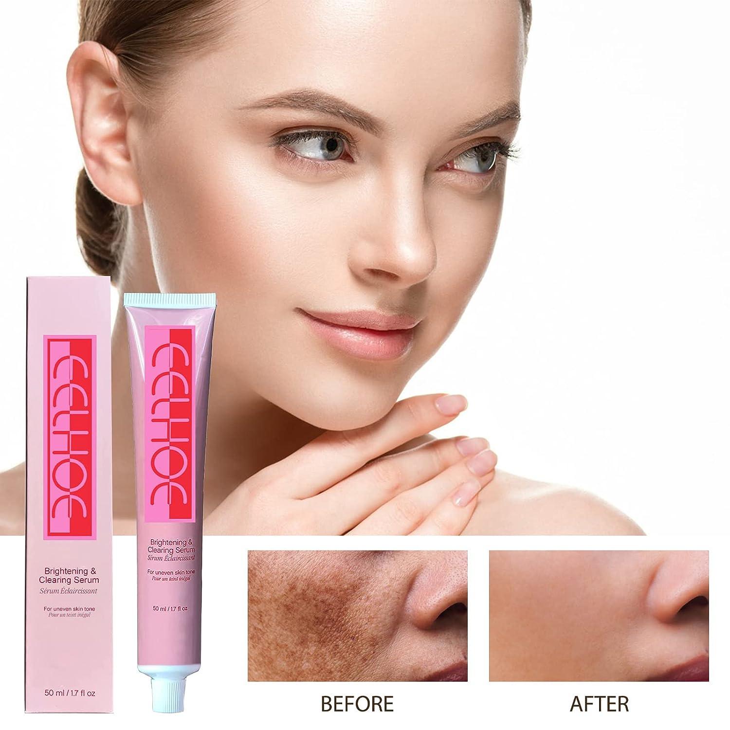 Dark Spot Corrector Serum for Face and Body - Brightening and Fading ...