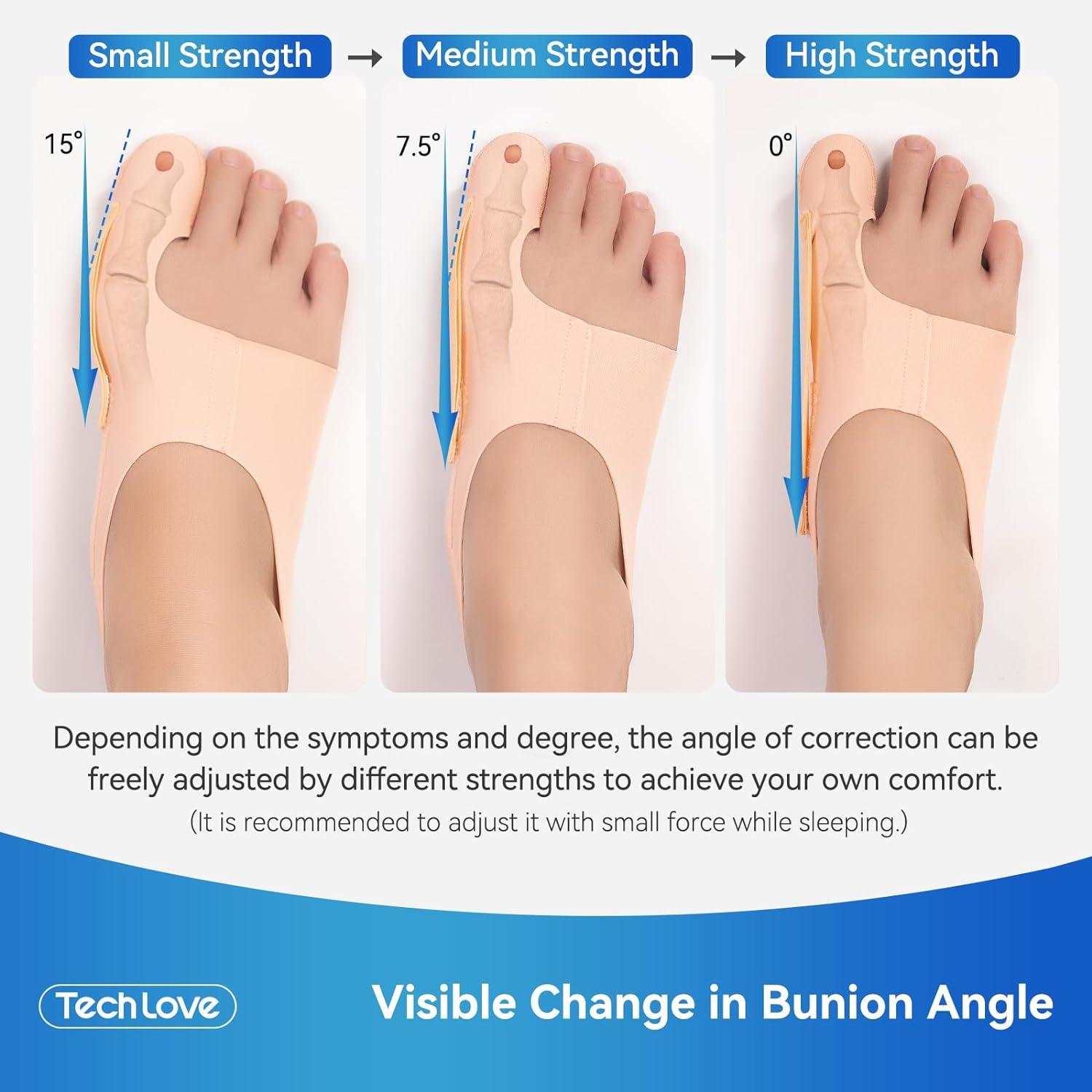 Tech Love Hallux Valgus Corrector & Toe Spreader - Comfort & Relief for ...