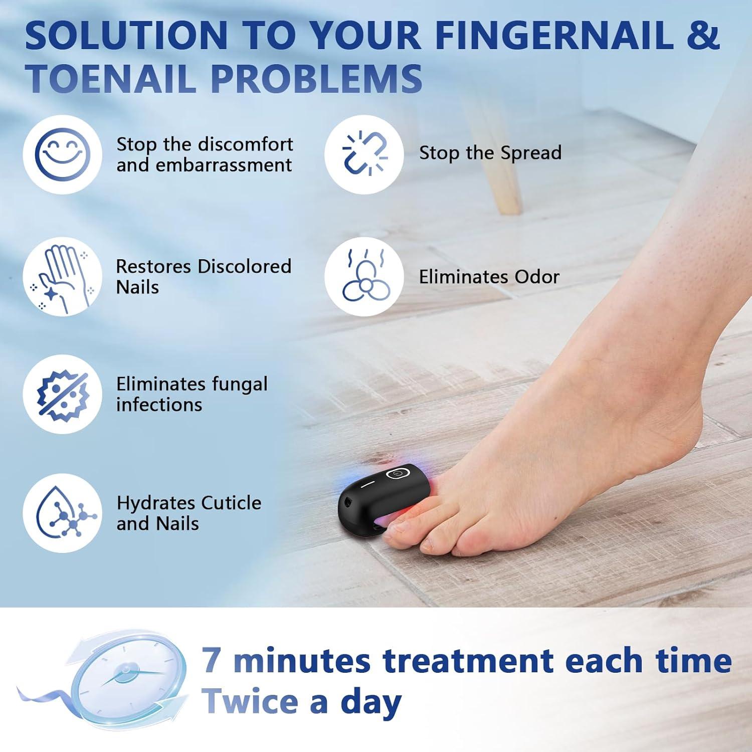 Nail Fungus Laser Treatment Device for Home Use | Effective ...