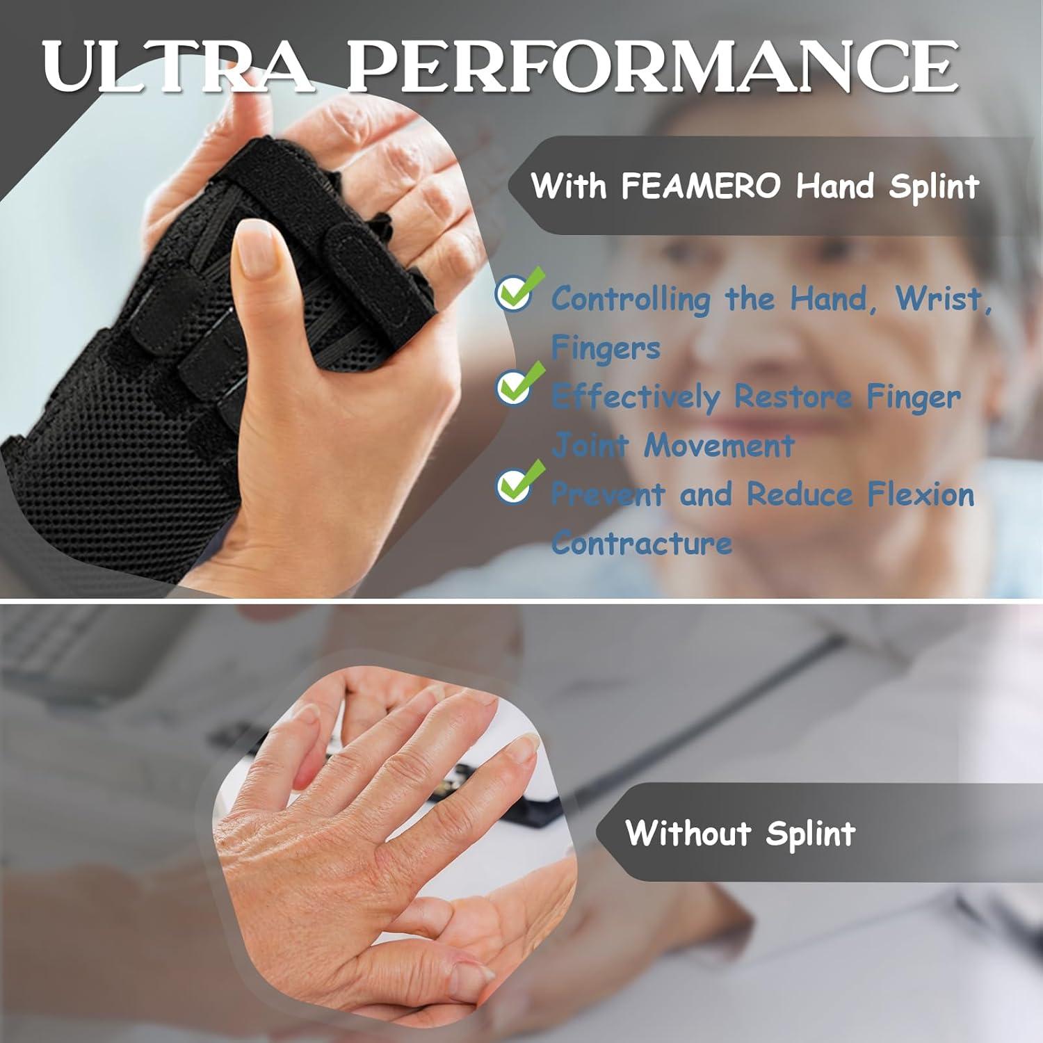 Adjustable Radial Nerve Palsy Splint - Finger Extension Brace for Drop ...