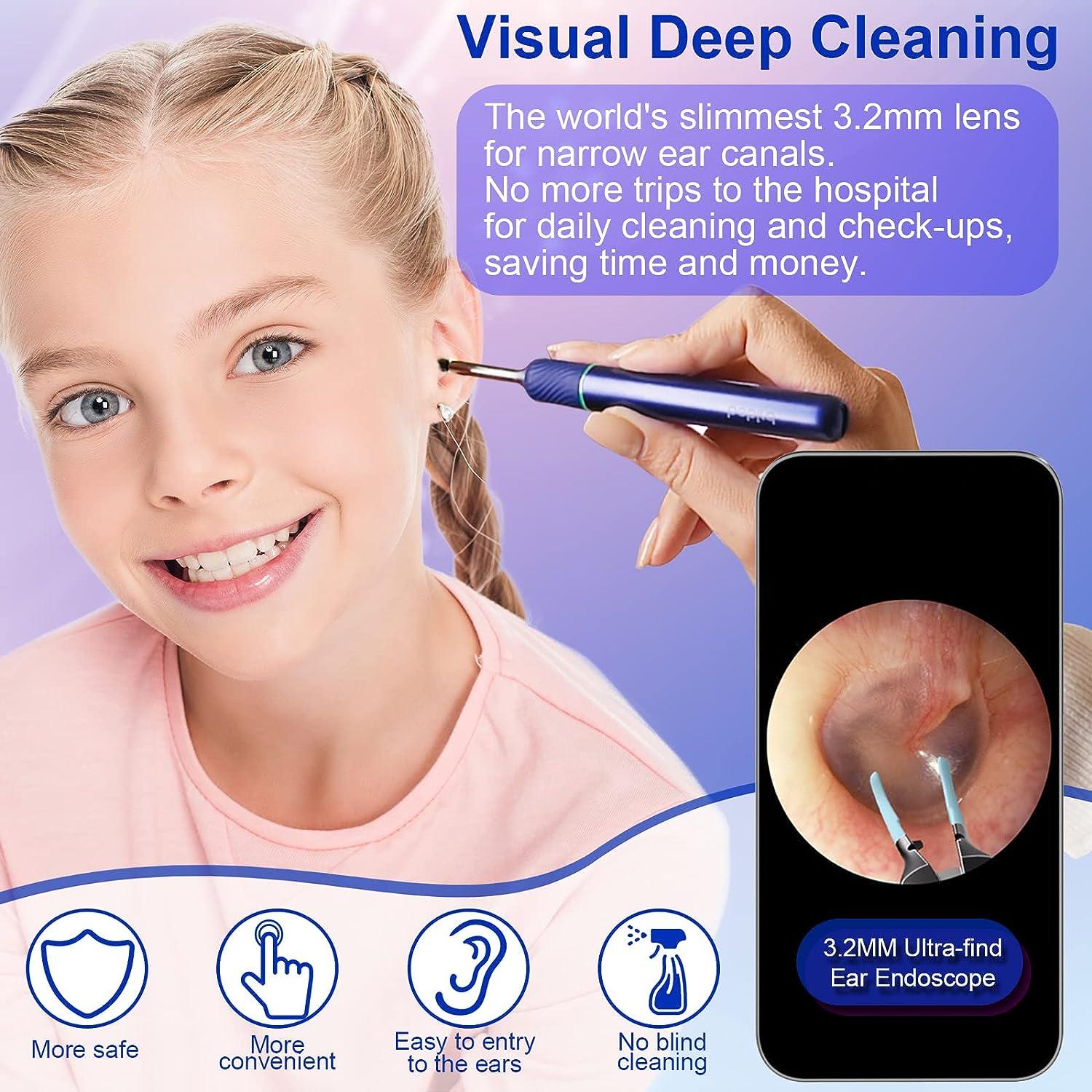 Bebird Note5 Pro Ear Wax Removal Tool Camera | 10MP HD Otoscope with Light | Ear Cleaner with ...