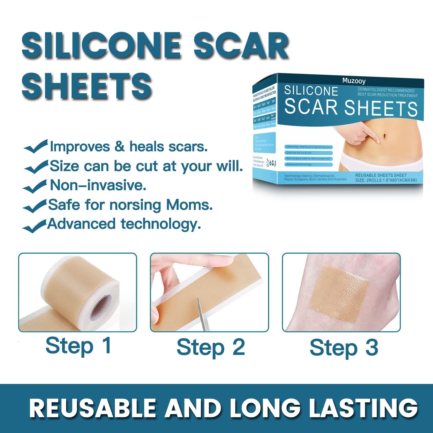 Medical Grade Silicone Scar Sheets (2 Rolls) - Acne, Burn, C-Section ...