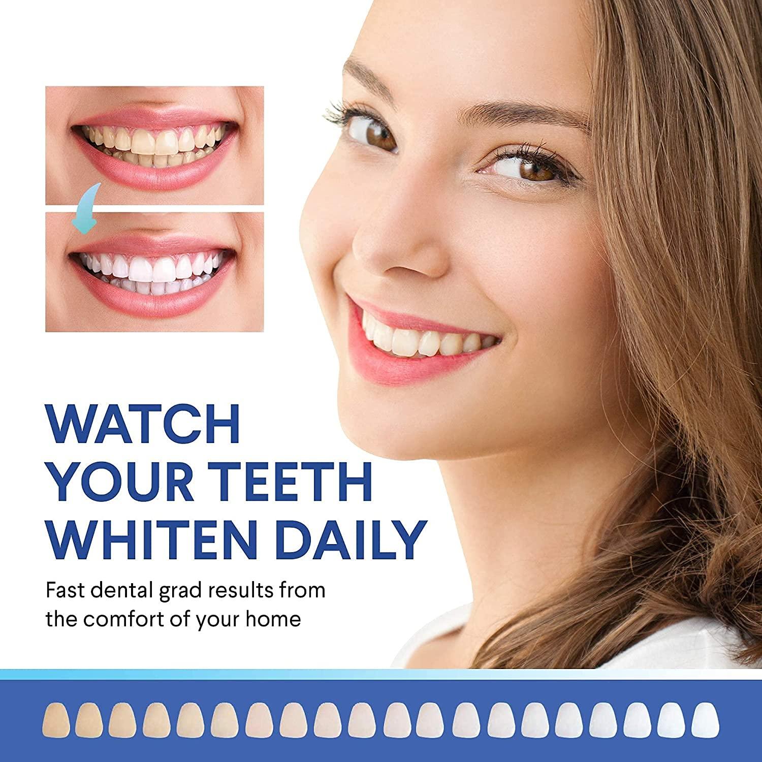 LUELLI Teeth Whitening Kit - 5X LED Tooth Whitener with 12ml Serum for Bright Smile | Buy Now ...