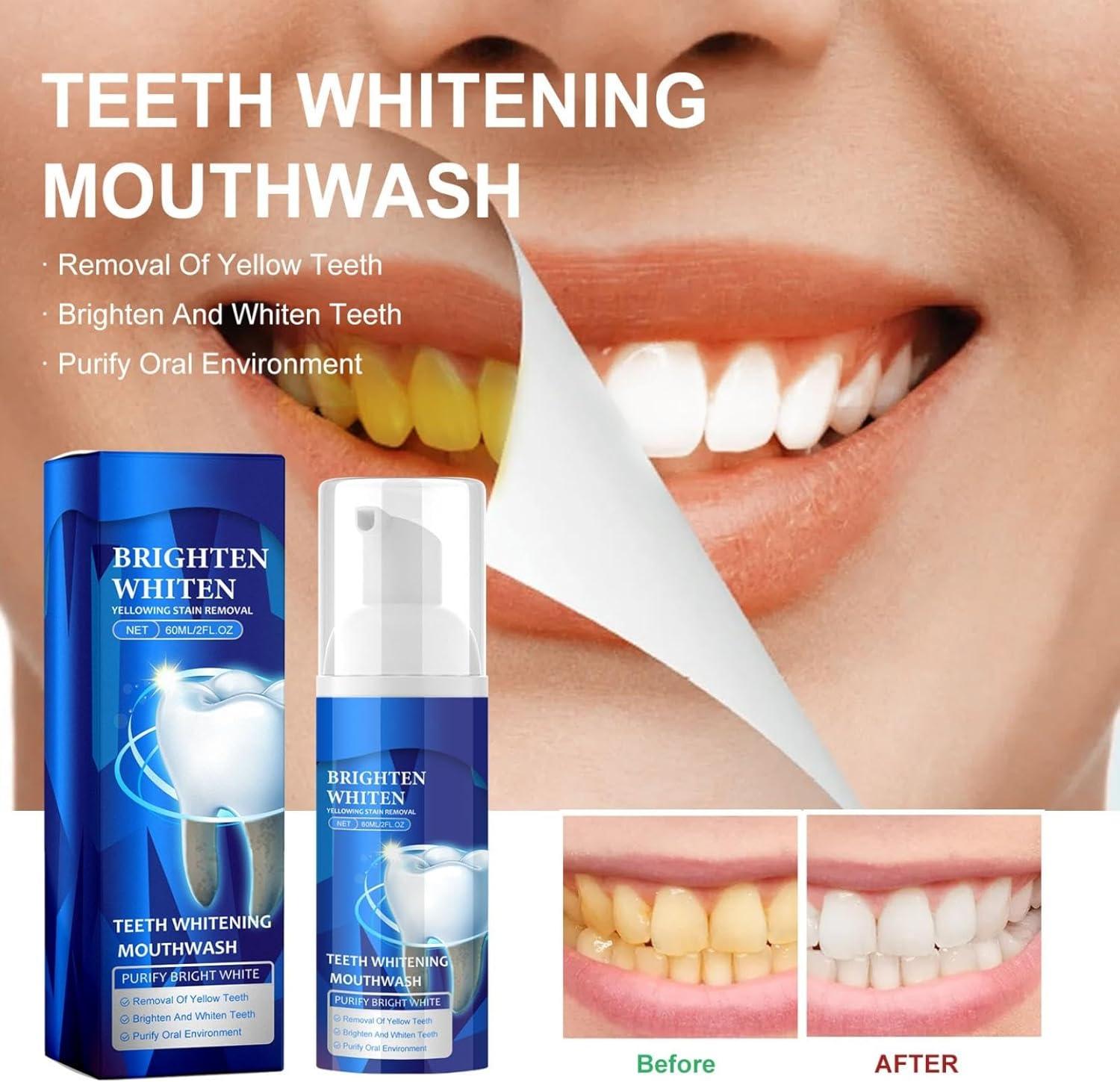 2PC Bright Whitening Teeth Mousse - Herbal Oral Repair & Mouthwash Foam ...