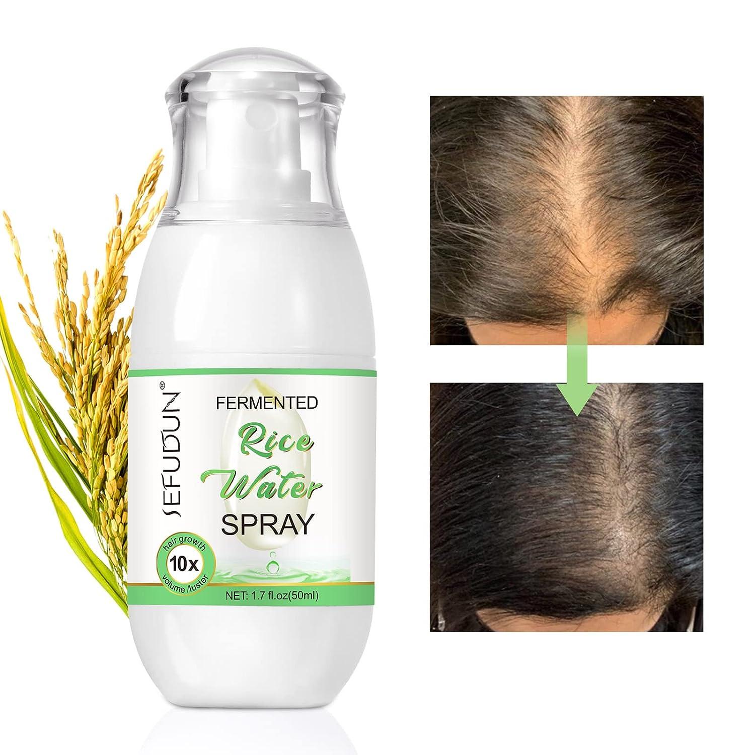 Fermented Rice Water Hair Growth Spray with Biotin & Caffeine - 50g/1 ...